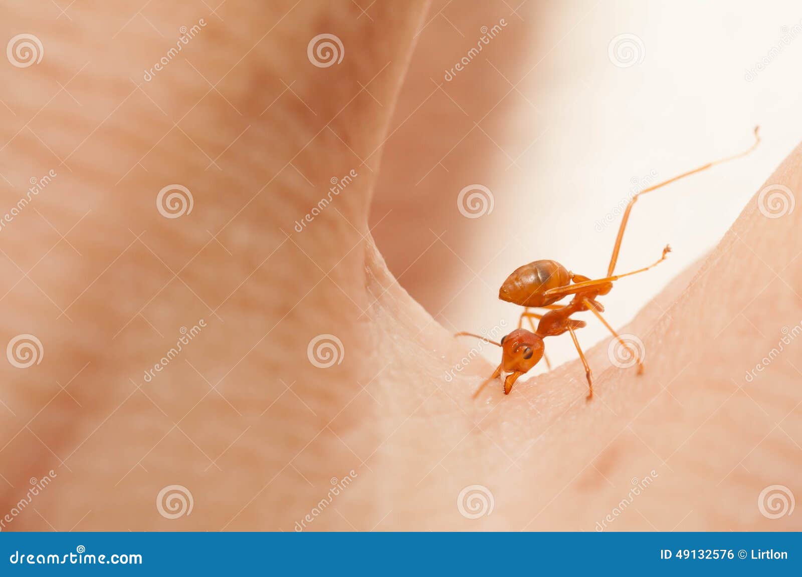 Angry Ant Attack by Bite and Spray Citric Acid Stock Photo - Image of ...