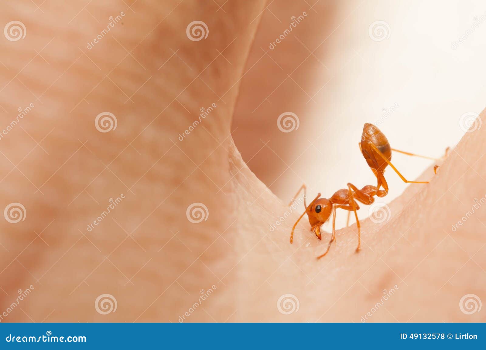 Angry Ant Attack by Bite and Spray Citric Acid Stock Photo - Image of ...