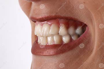 Angry Look stock image. Image of people, hair, rudeness - 2901689