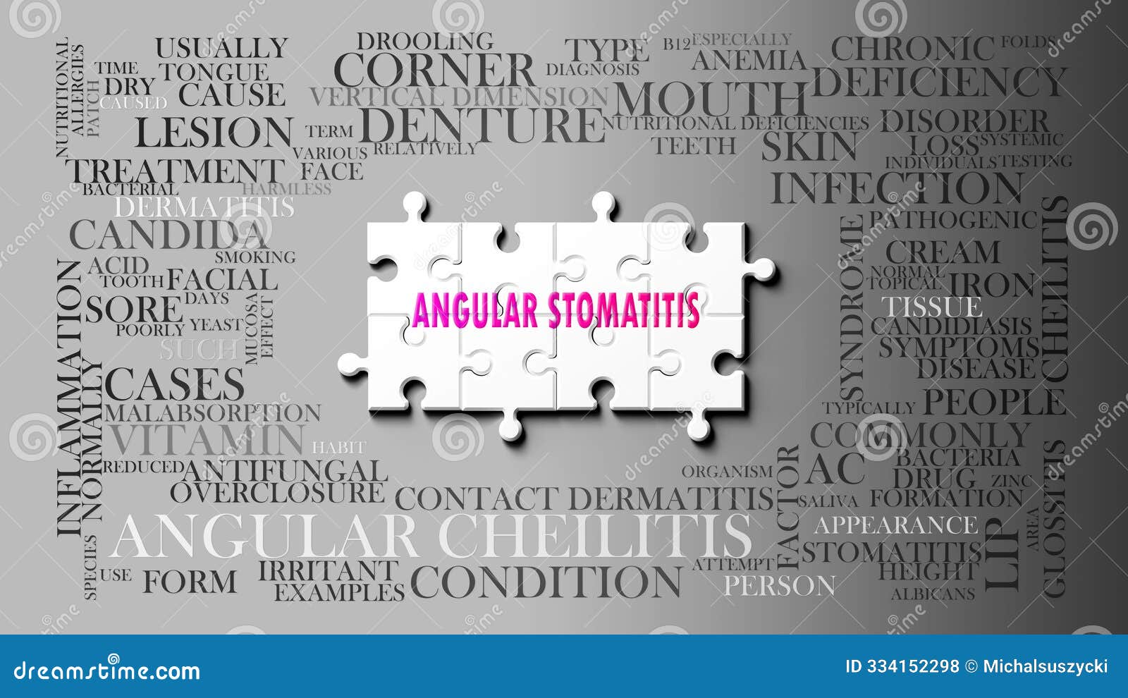 Angular Stomatitis Or Angular Cheilitis Or Perleche In Asian Little Boy ...