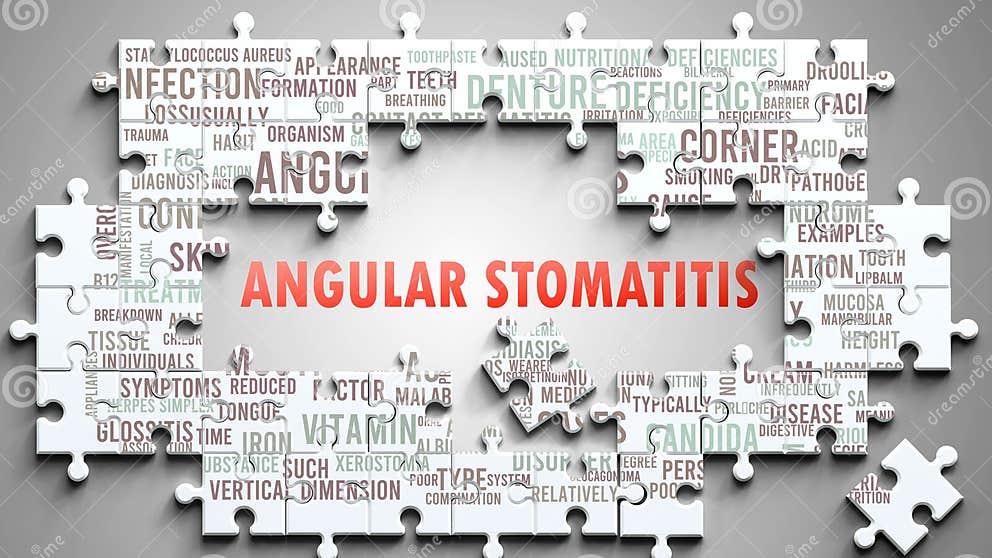 Angular Stomatitis As a Complex Subject, Related To Various Topics and ...