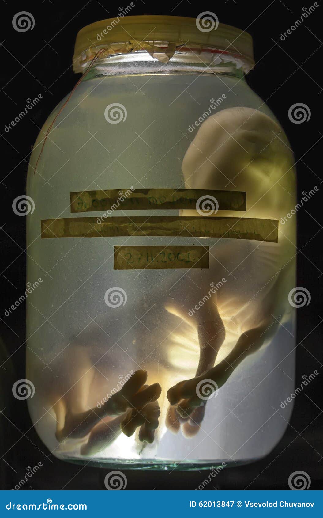 Animal Embryos in Formaldehyde Stock Image - Image of grow, container ...