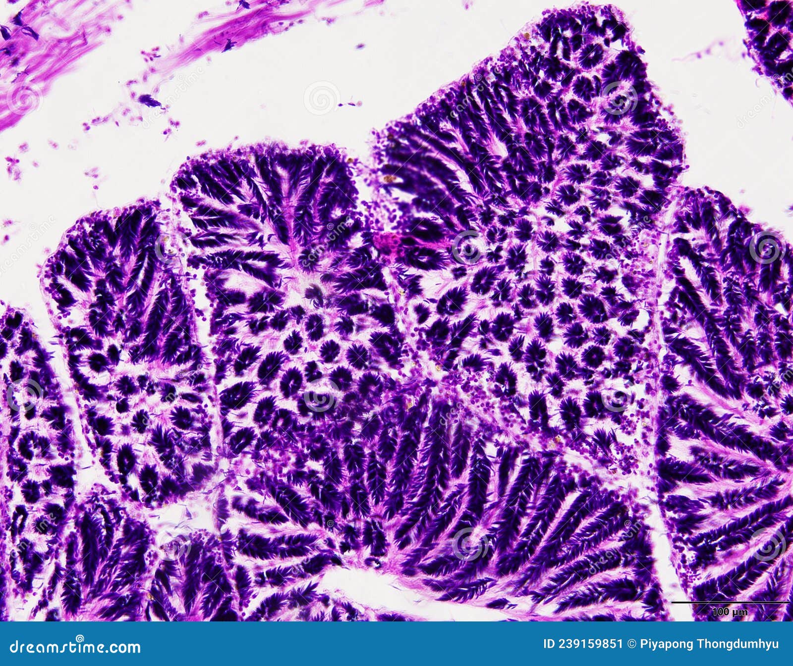 Animal Tissue Samples Under the Microscope. Stock Image - Image of ...