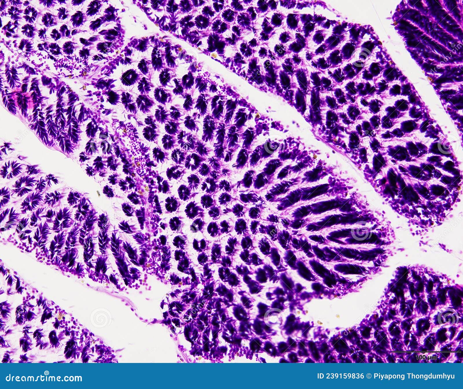 Animal Tissue Samples Under the Microscope. Stock Photo - Image of ...