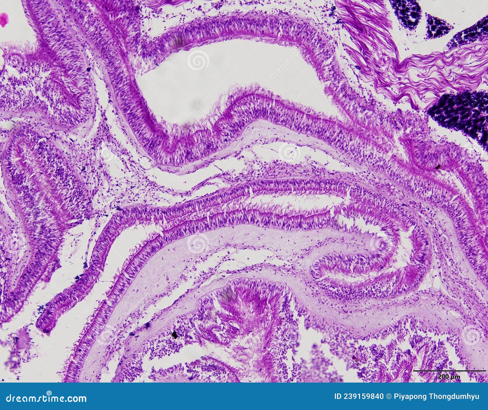 Animal Tissue Samples Under the Microscope. Stock Photo - Image of ...