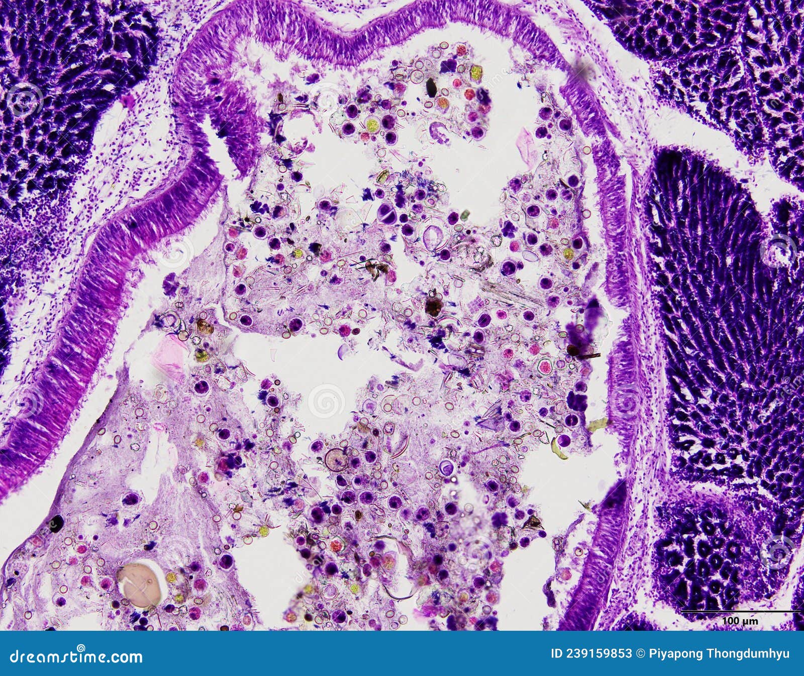 Animal Tissue Samples Under the Microscope. Stock Image - Image of ...