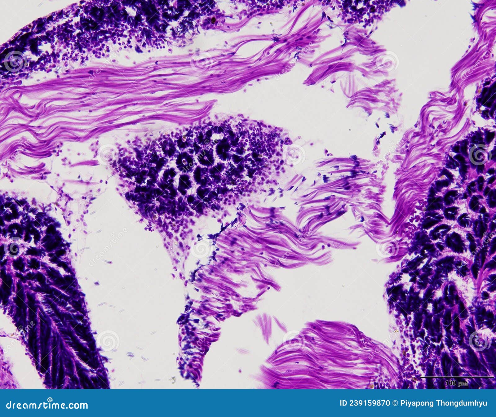 Animal Tissue Samples Under the Microscope. Stock Photo - Image of ...