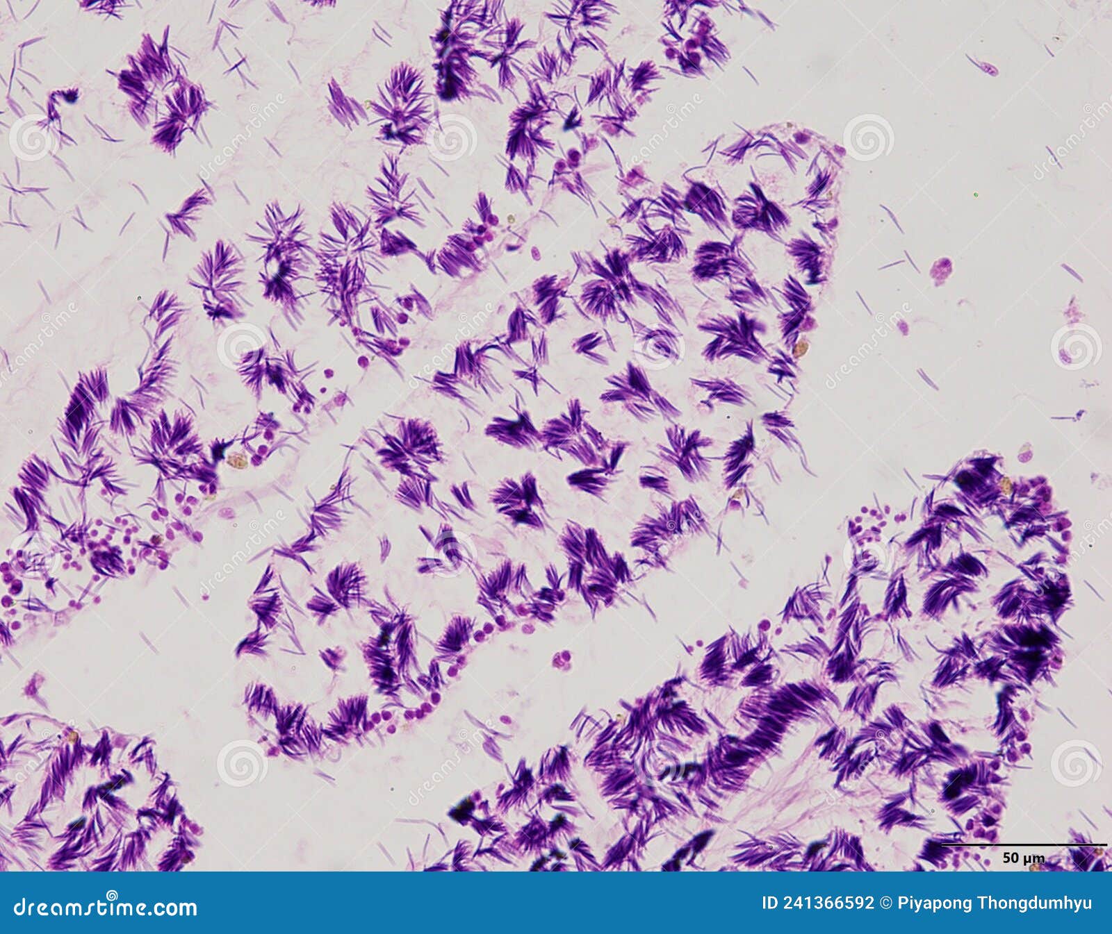 Animal Tissue Samples Under the Microscope. Stock Photo - Image of ...
