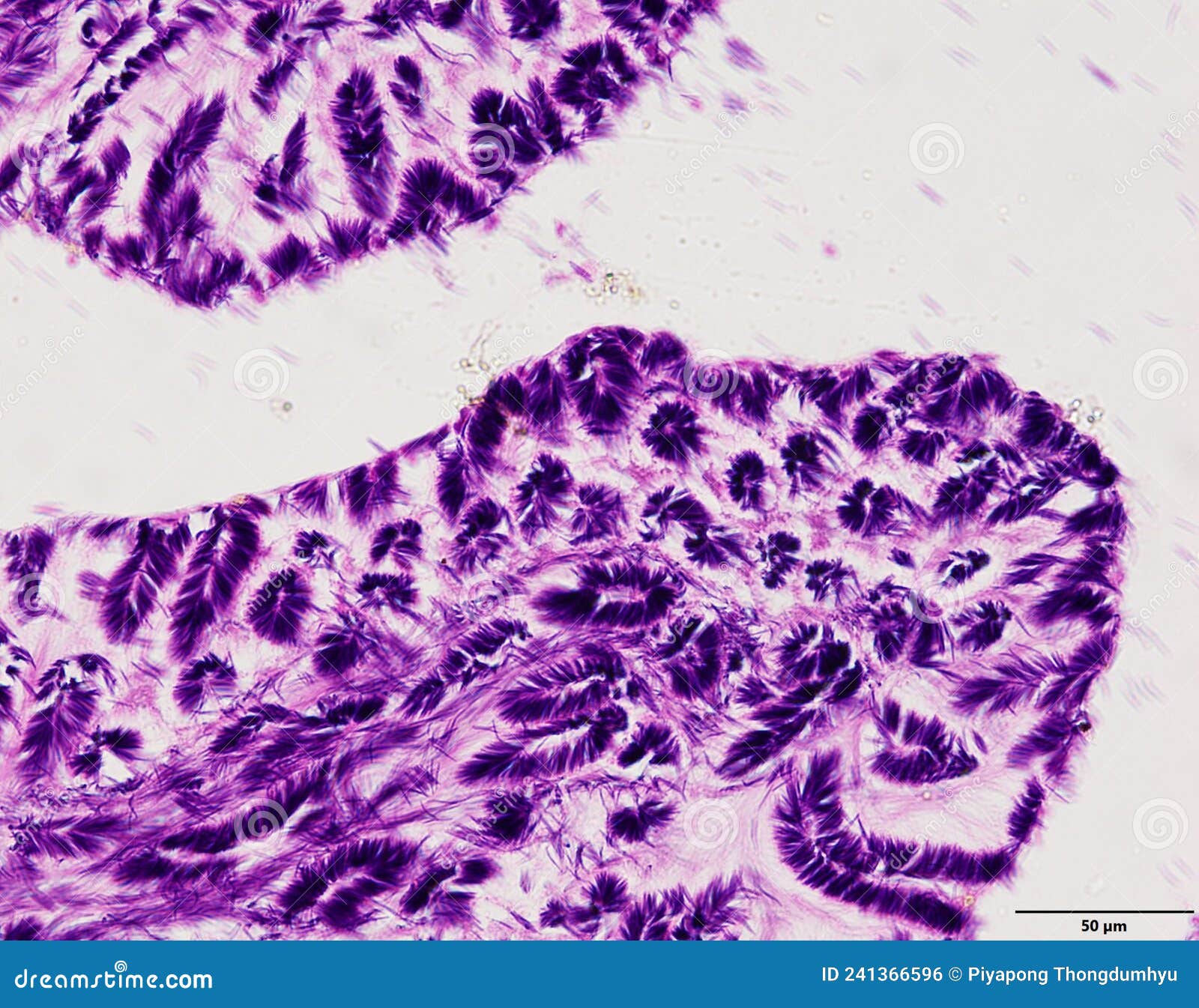 Animal Tissue Samples Under the Microscope. Stock Photo - Image of ...