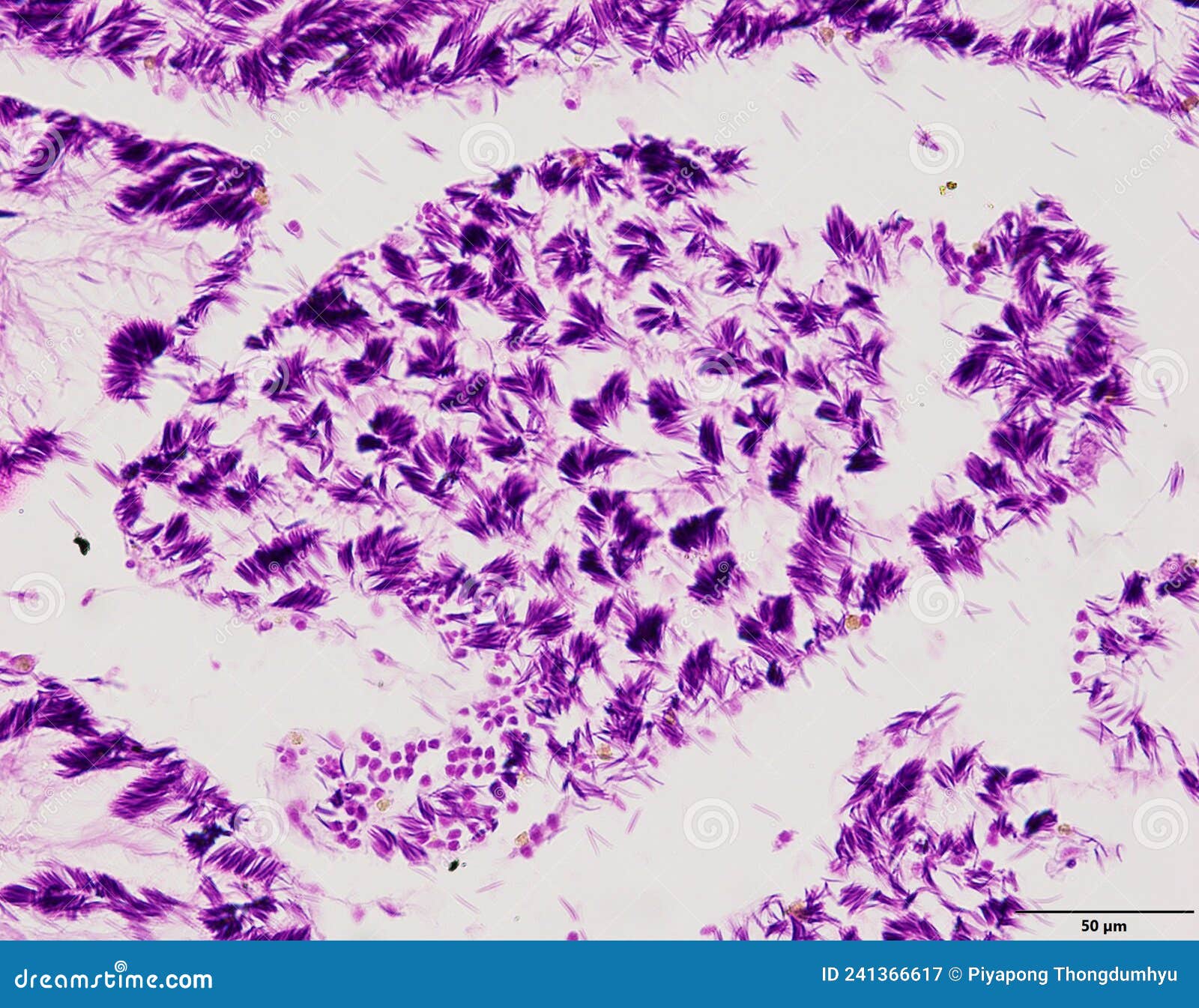 Animal Tissue Samples Under the Microscope. Stock Image - Image of ...