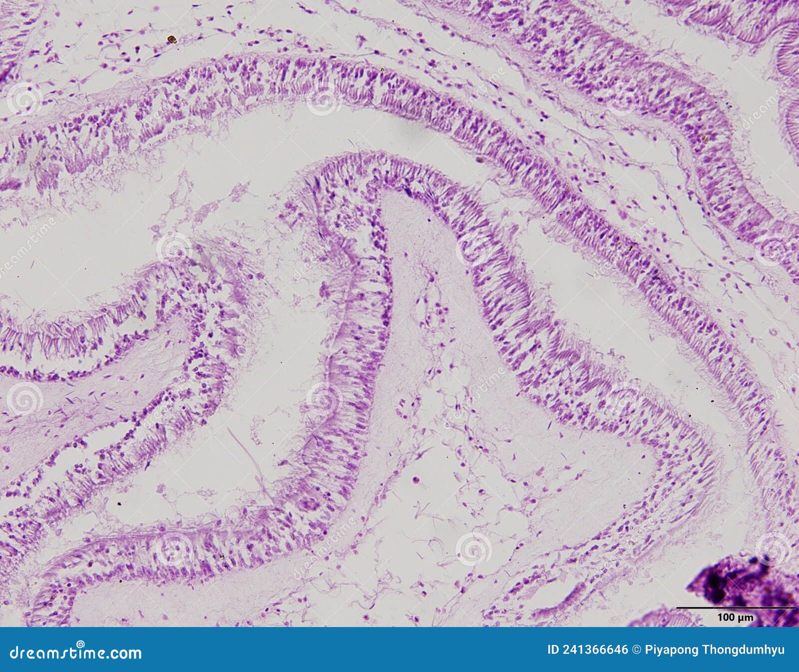 Animal Tissue Samples Under the Microscope. Stock Photo - Image of ...