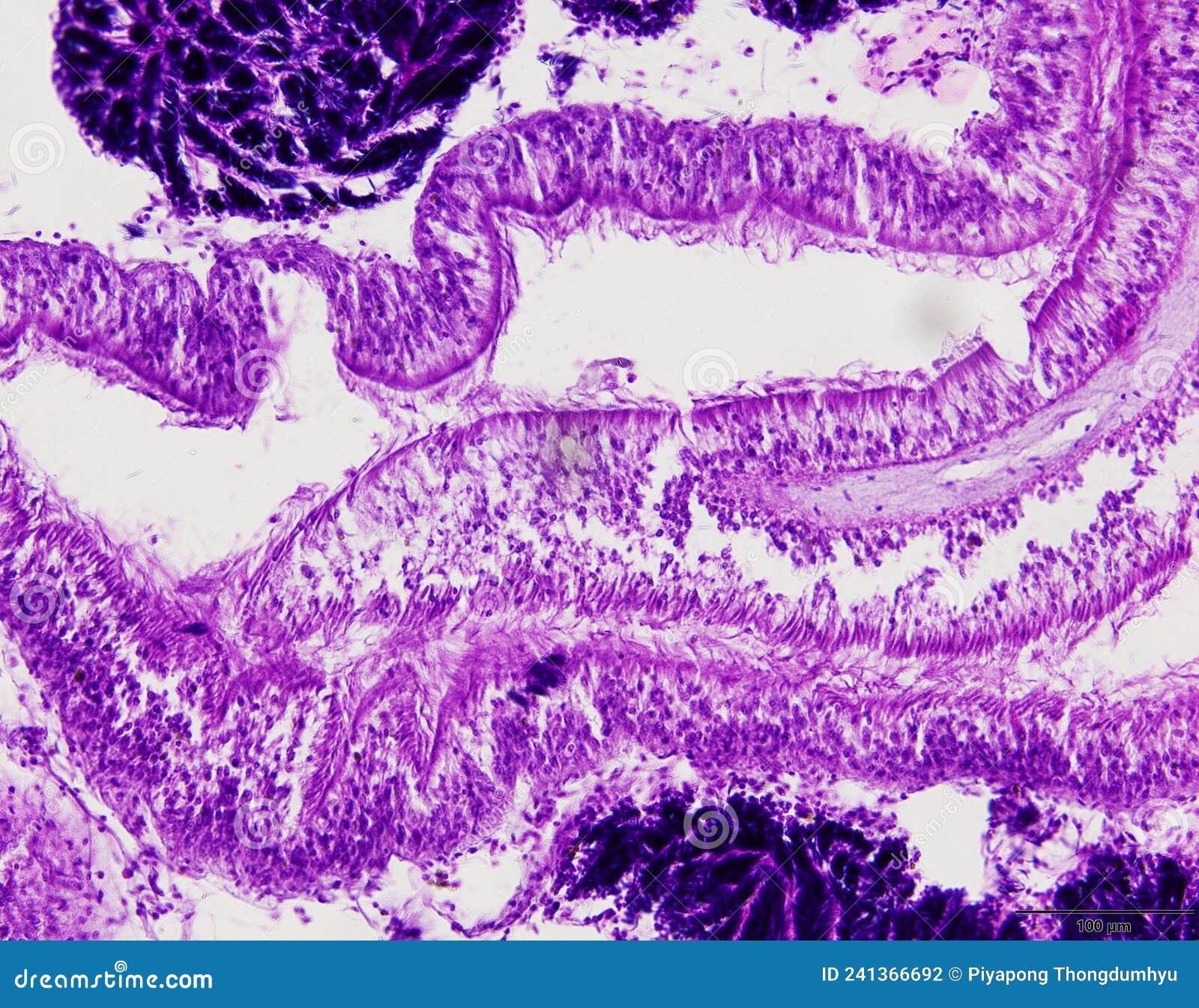 Animal Tissue Samples Under the Microscope. Stock Photo - Image of ...