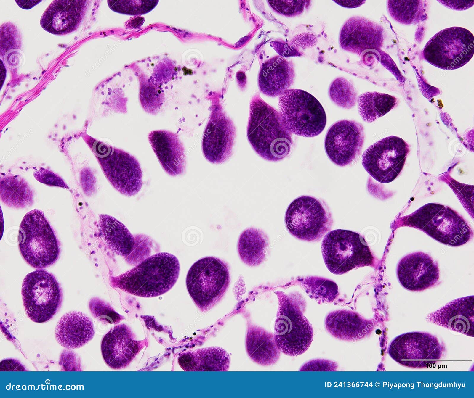 Animal Tissue Samples Under the Microscope. Stock Photo - Image of ...