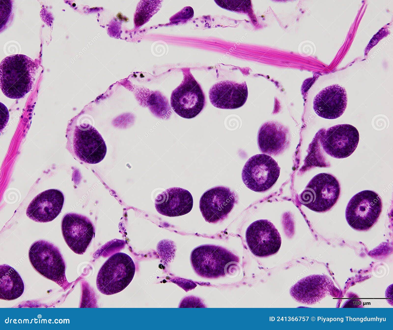 Animal Tissue Samples Under the Microscope. Stock Image - Image of ...