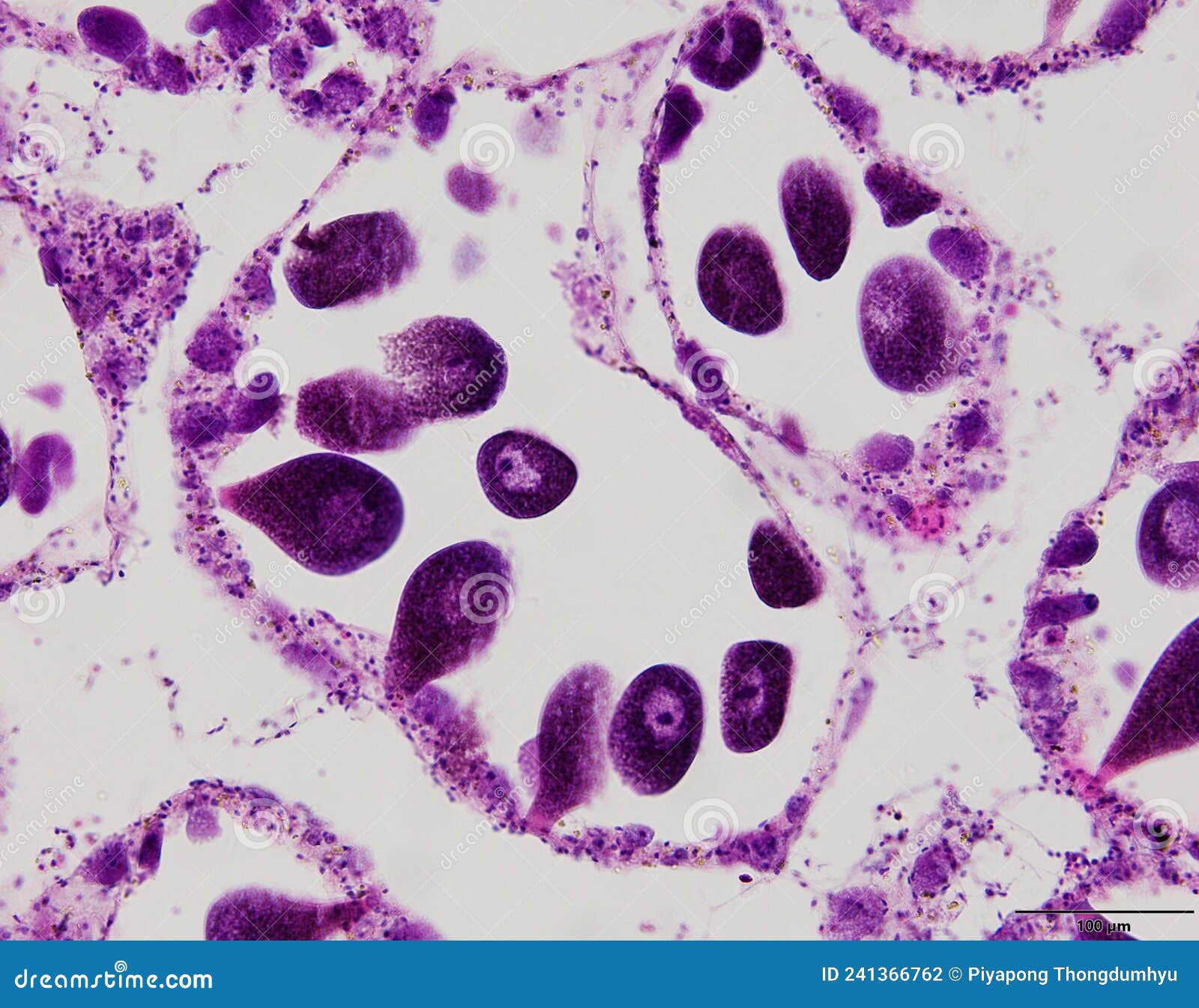 Animal Tissue Samples Under the Microscope. Stock Photo - Image of ...