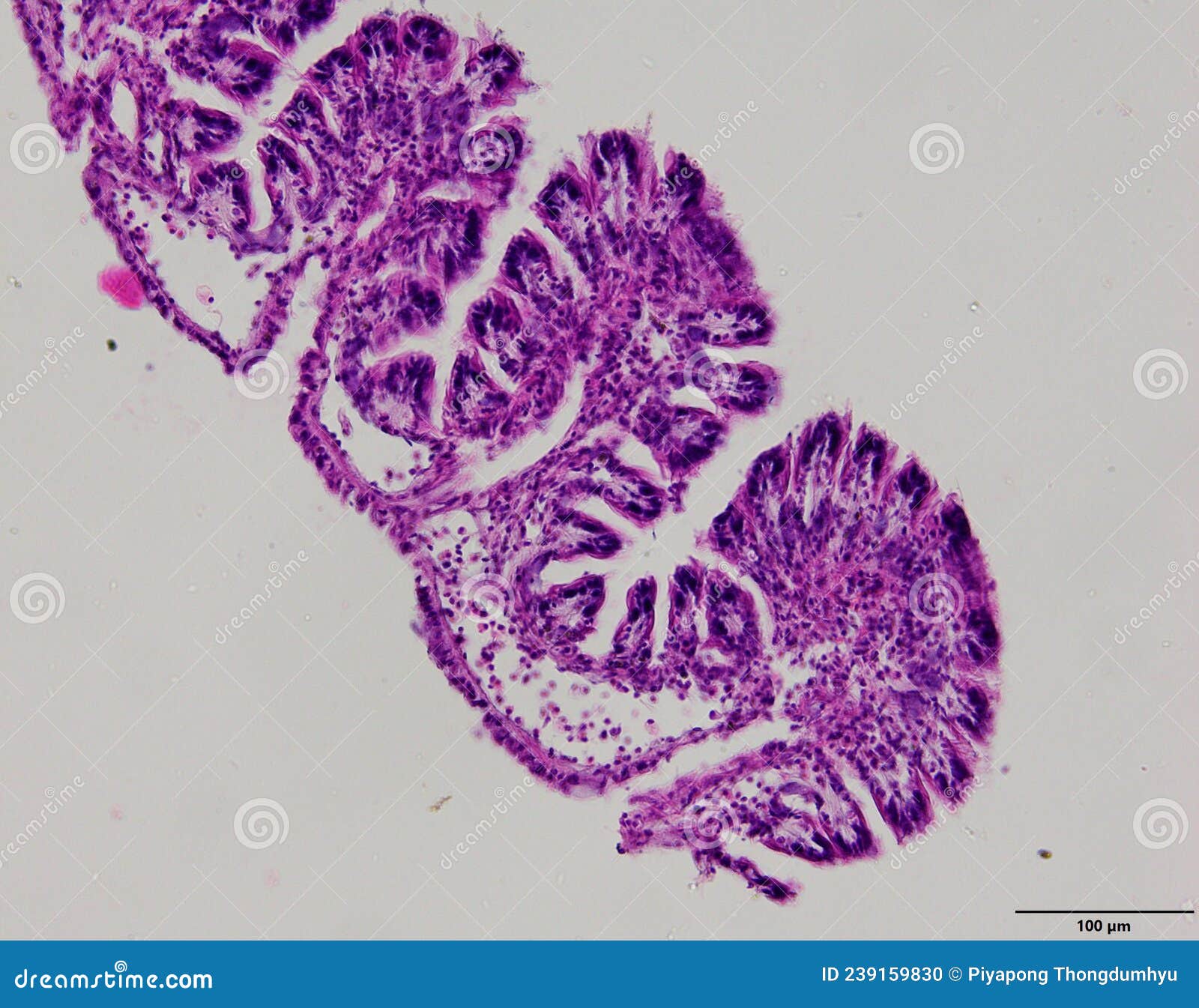 Animal Tissue Samples Under the Microscope. Stock Photo - Image of ...