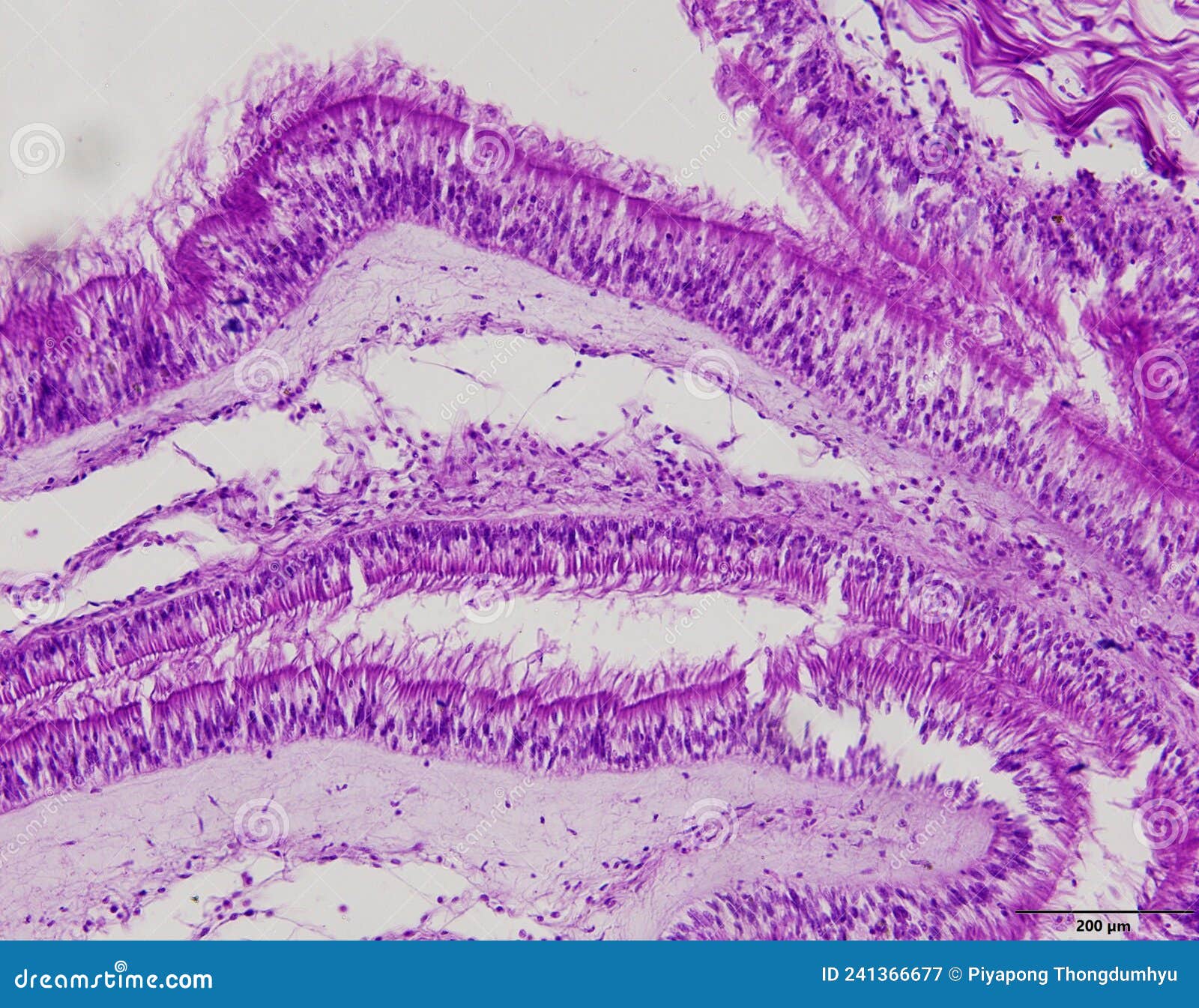 Animal Tissue Samples Under the Microscope. Stock Image - Image of ...