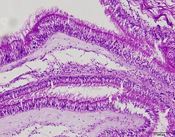 Animal Tissue Samples Under the Microscope. Stock Image - Image of ...