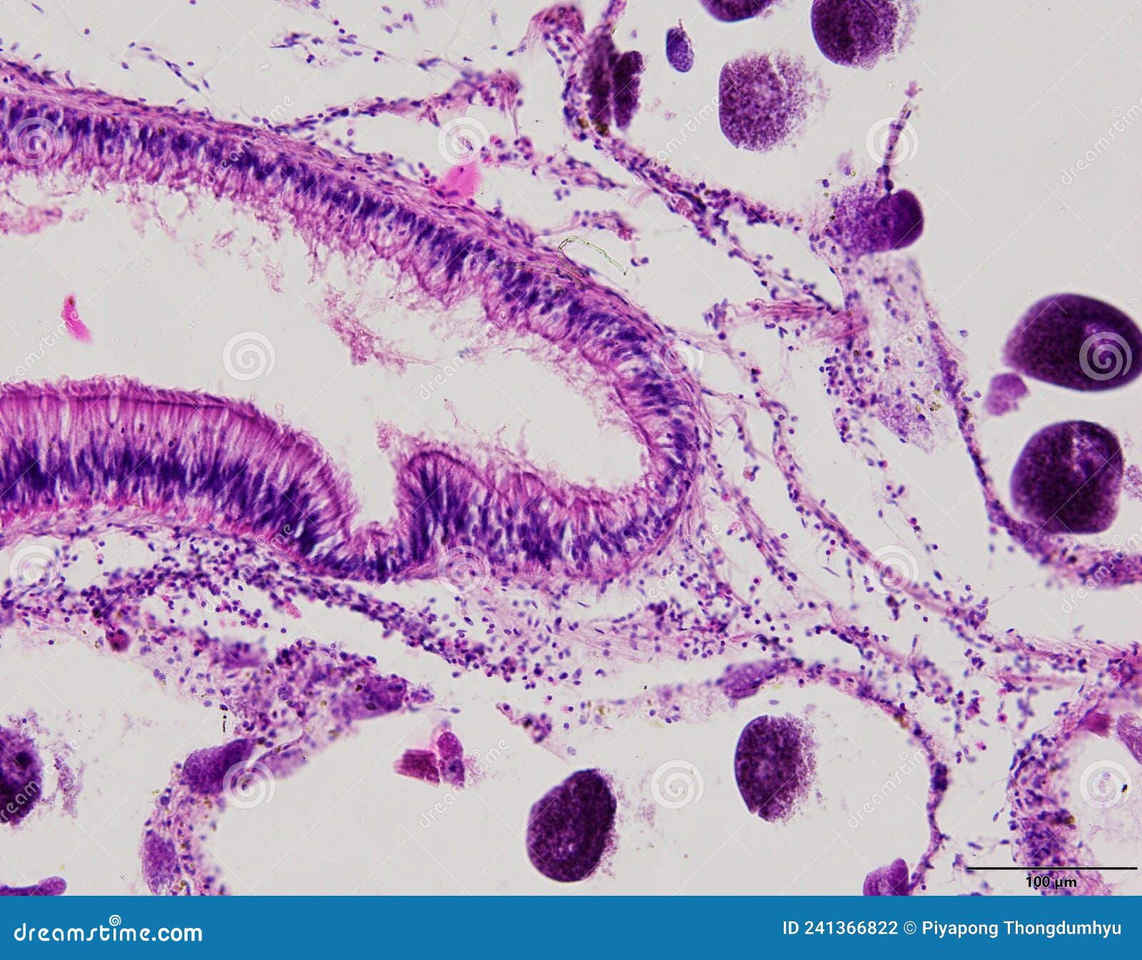 Animal Tissue Samples Under the Microscope. Stock Photo - Image of ...