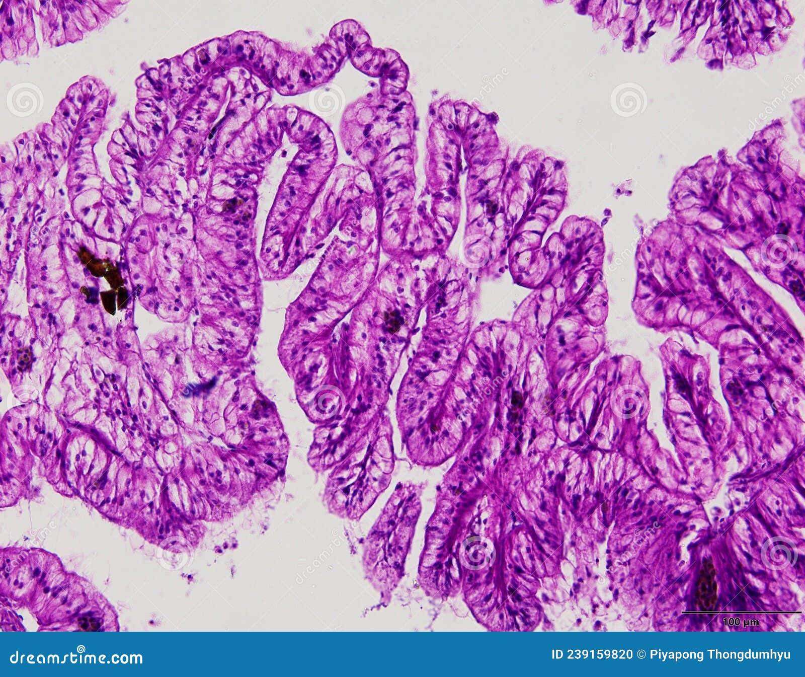 Animal Tissue Samples Under the Microscope. Stock Photo - Image of ...