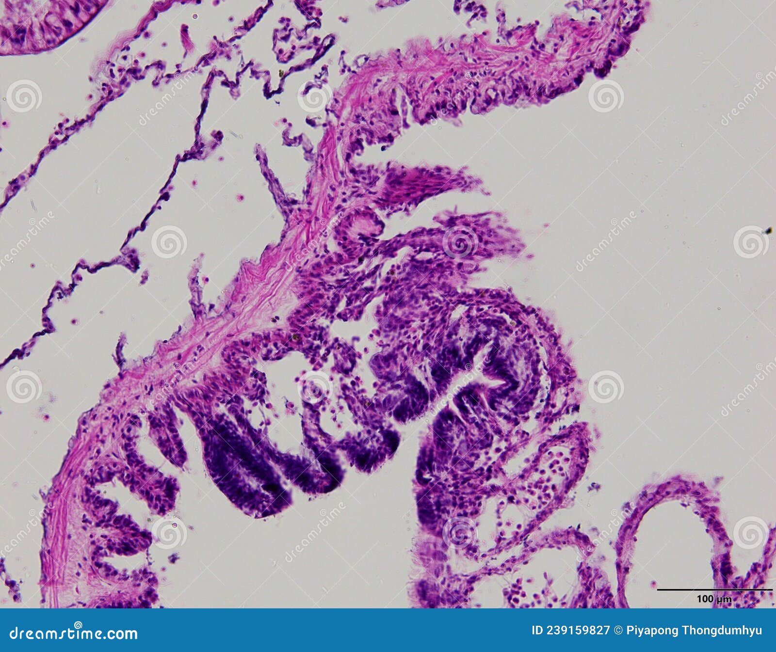 Animal Tissue Samples Under the Microscope. Stock Image - Image of ...
