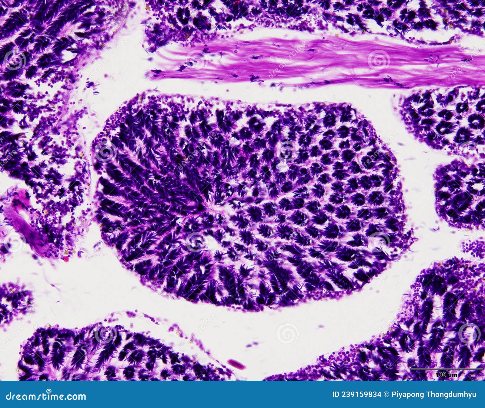 Animal Tissue Samples Under the Microscope. Stock Photo - Image of ...