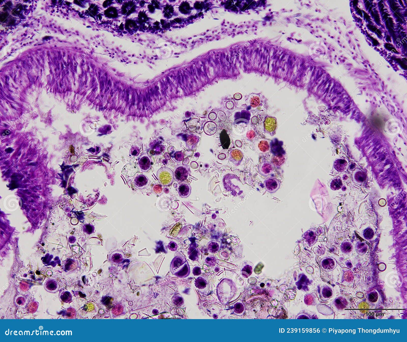 Animal Tissue Samples Under the Microscope. Stock Photo - Image of ...