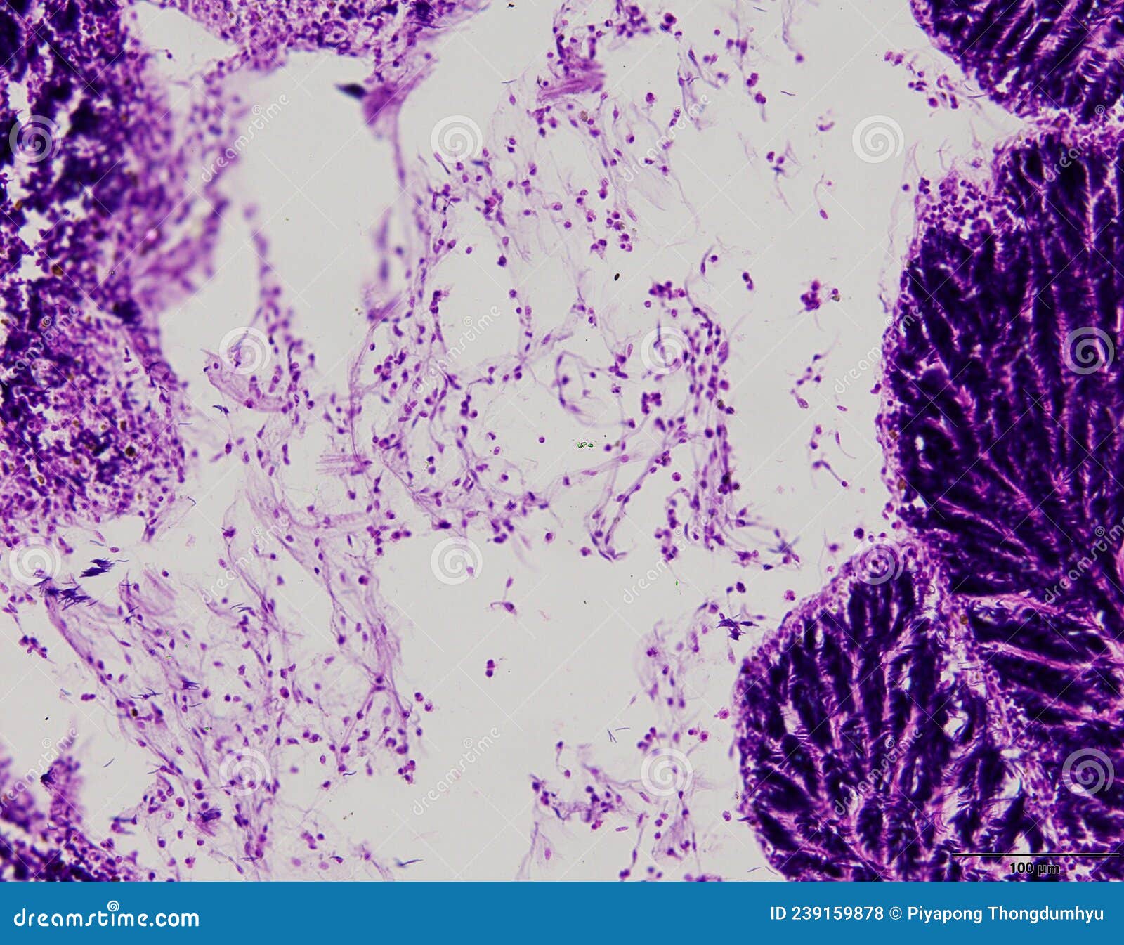 Animal Tissue Samples Under the Microscope. Stock Photo - Image of ...
