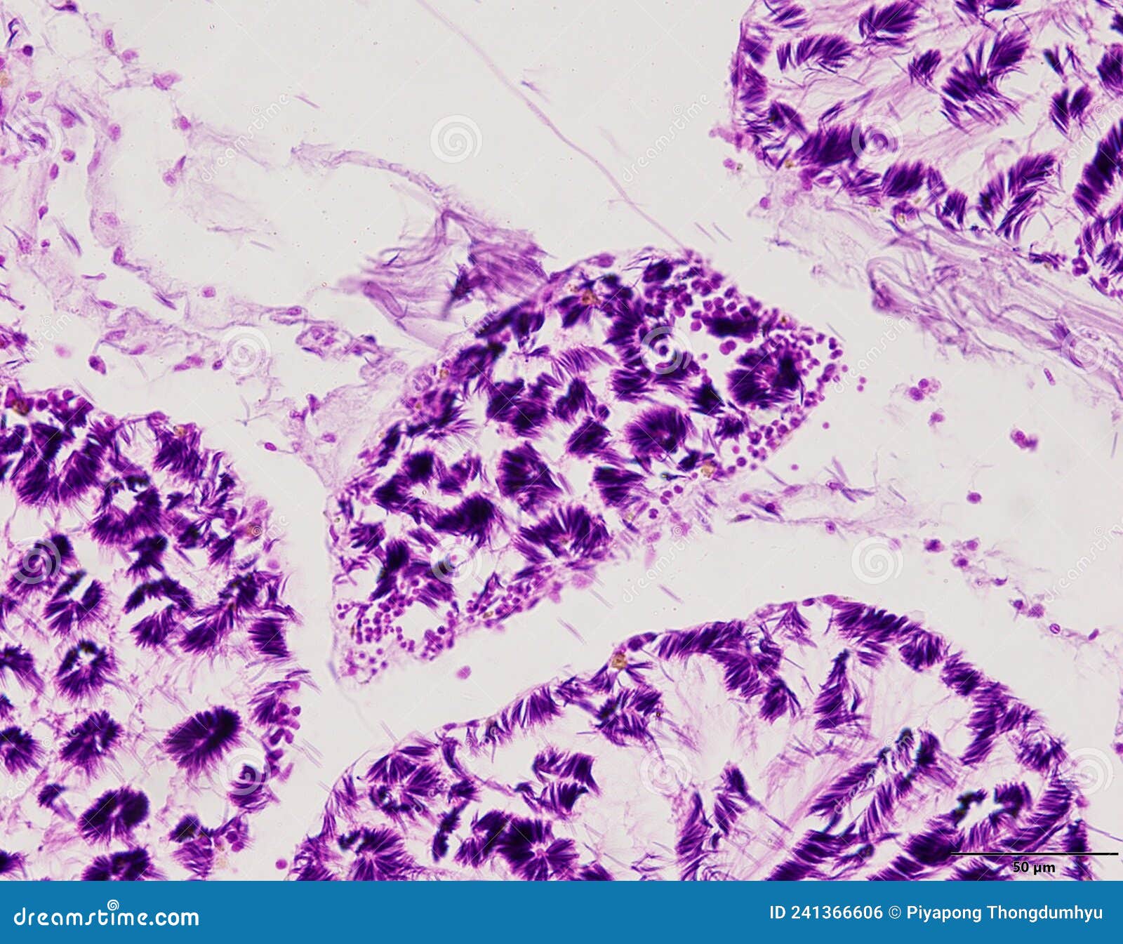 Animal Tissue Samples Under the Microscope. Stock Photo - Image of ...