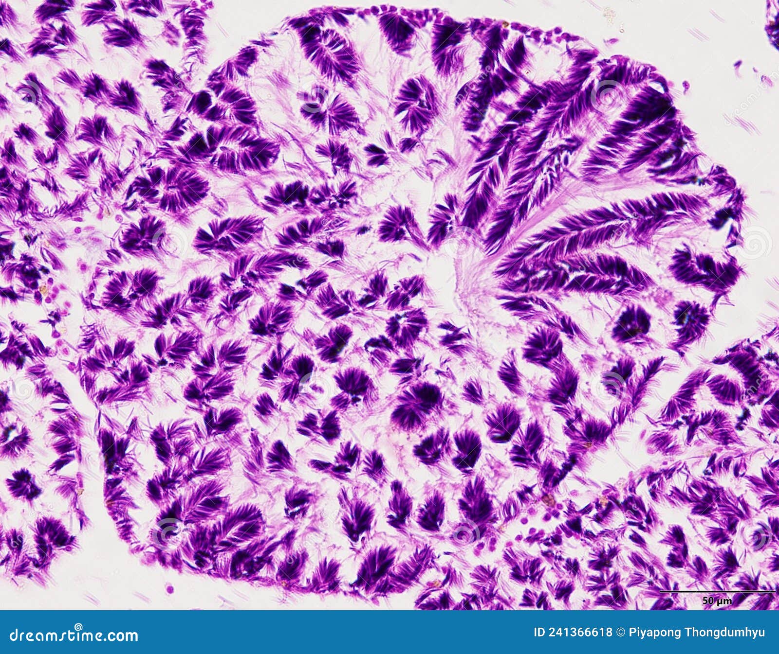 Animal Tissue Samples Under the Microscope. Stock Photo - Image of ...