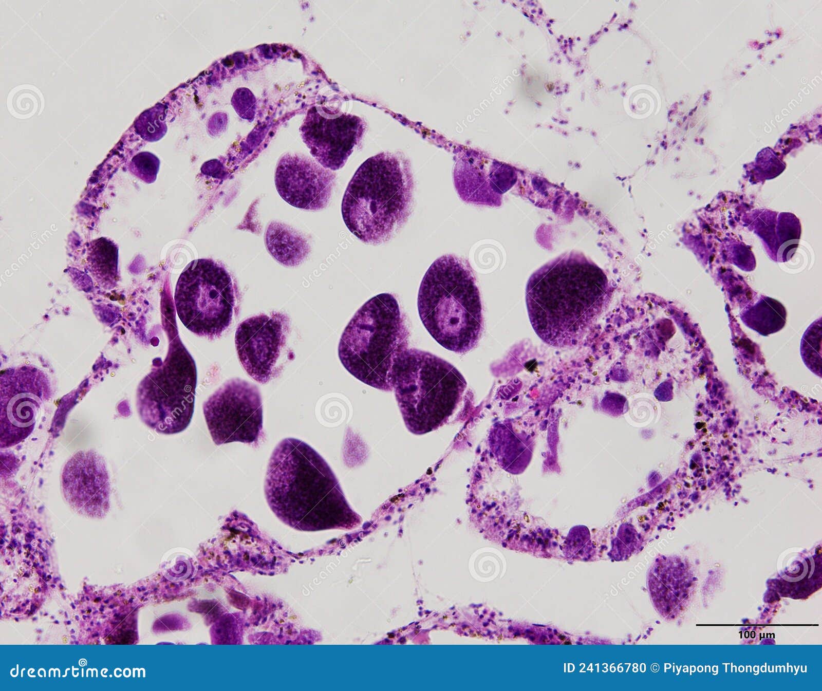 Animal Tissue Samples Under the Microscope. Stock Photo - Image of ...