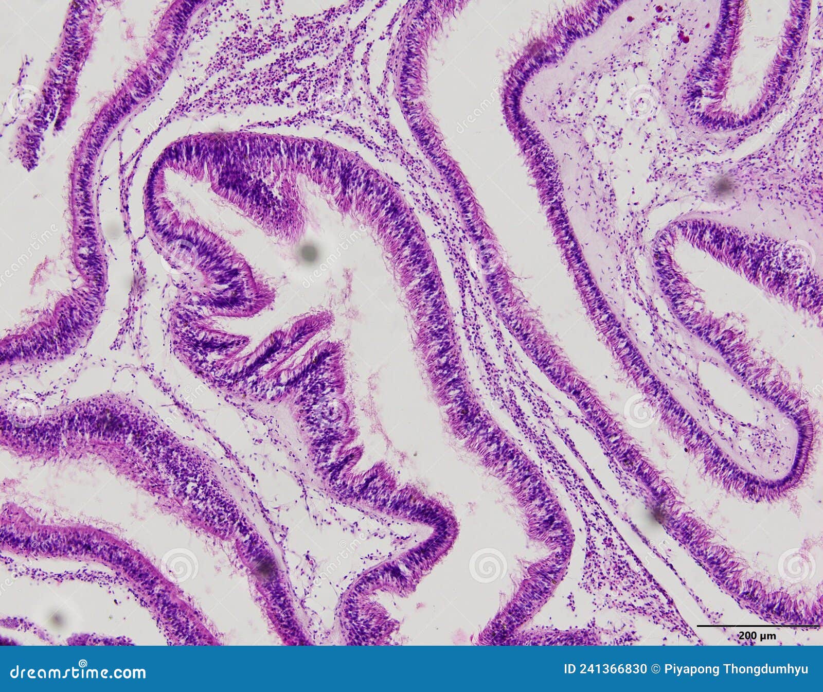 Animal Tissue Samples Under the Microscope. Stock Photo - Image of cell ...