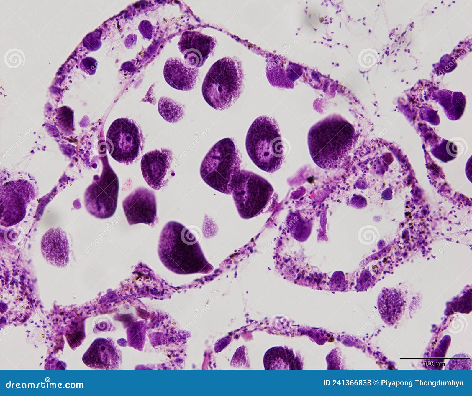 Animal Tissue Samples Under the Microscope. Stock Photo - Image of ...