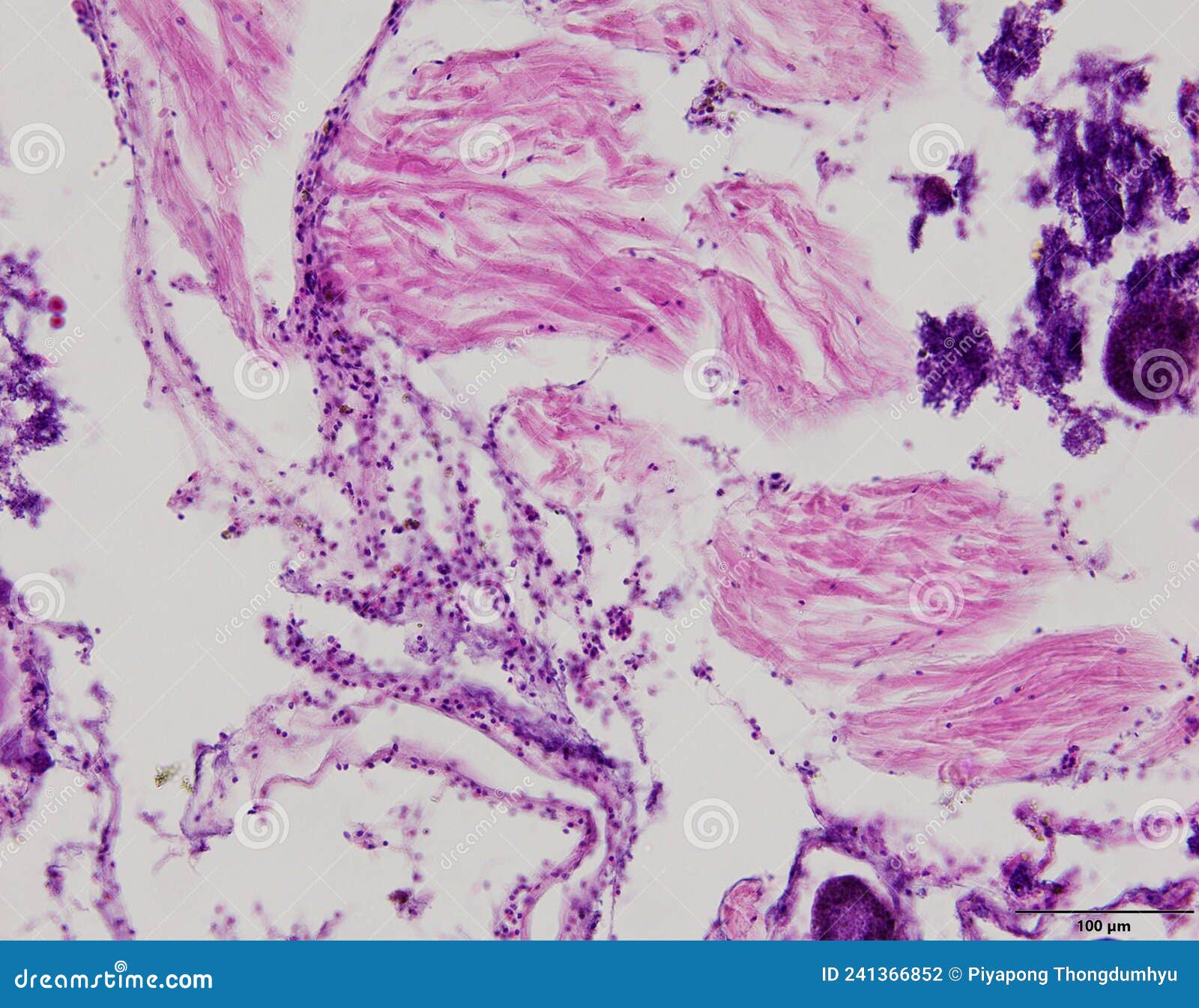 Animal Tissue Samples Under the Microscope. Stock Photo - Image of ...