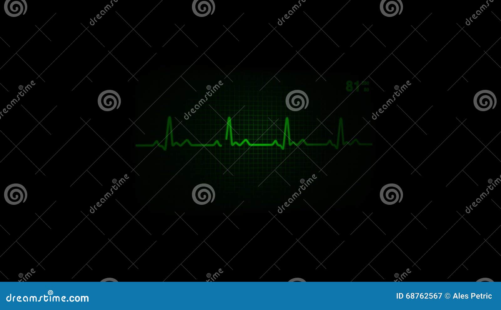 Animated Lifeline with Heartbeat Stock Video - Video of health, beat ...