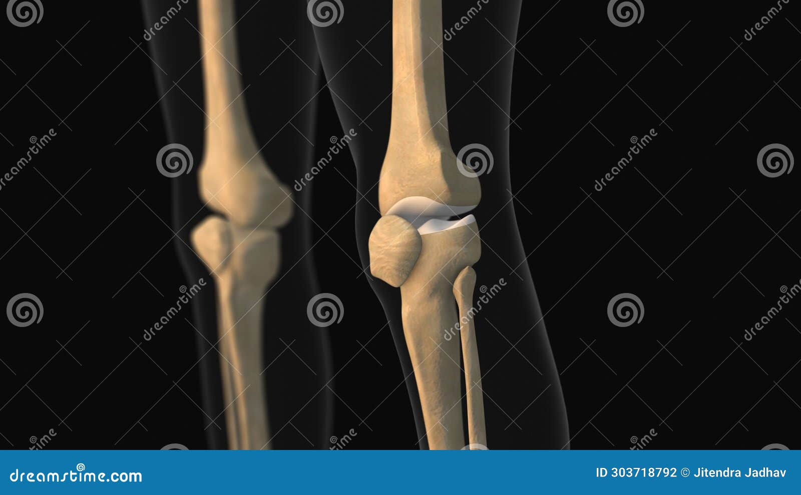 Medical Animation of the Patella Bone Pain Stock Photo - Image of ...