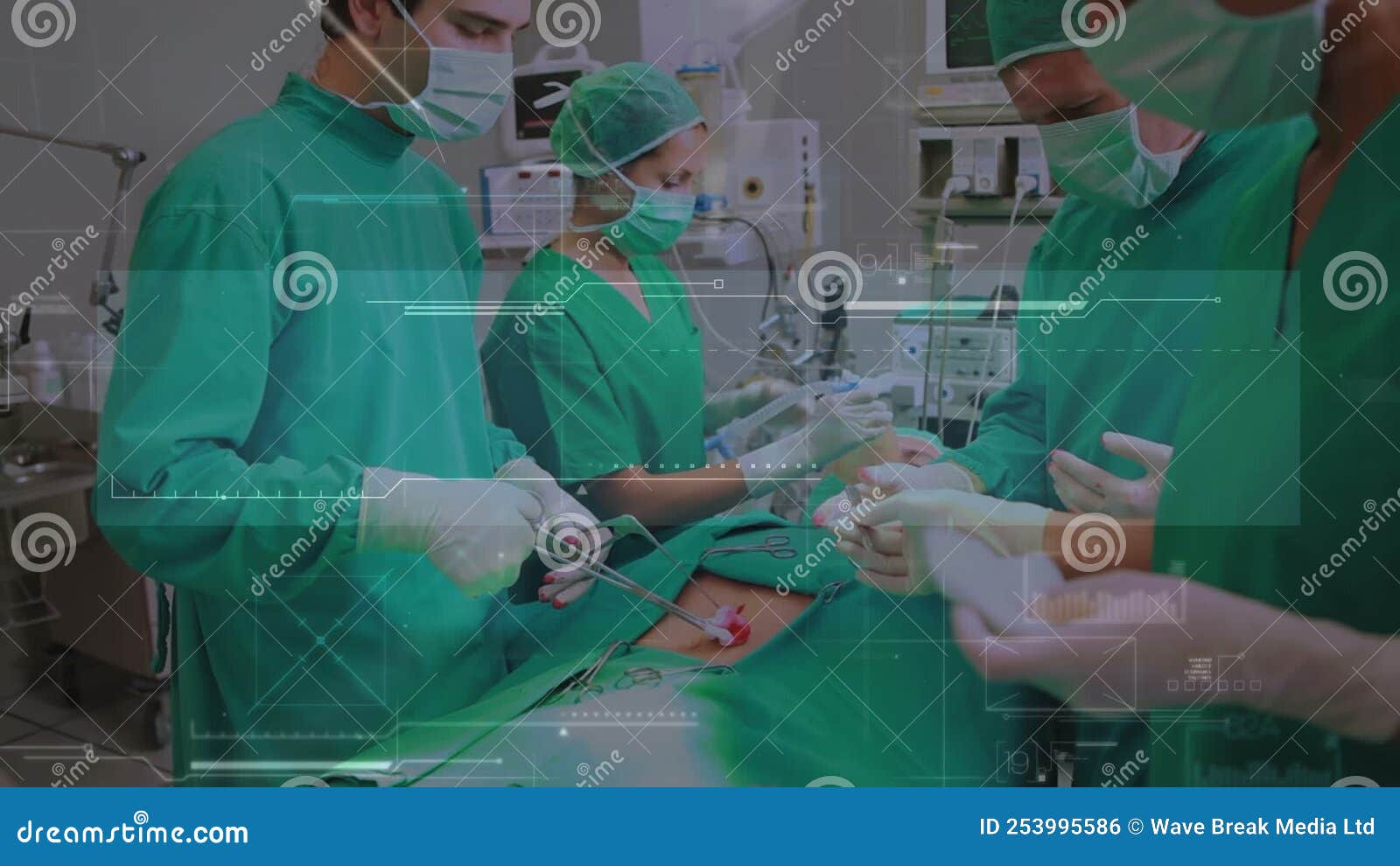 Animation of Data Processing Over Diverse Surgeons in Operating Theatre ...