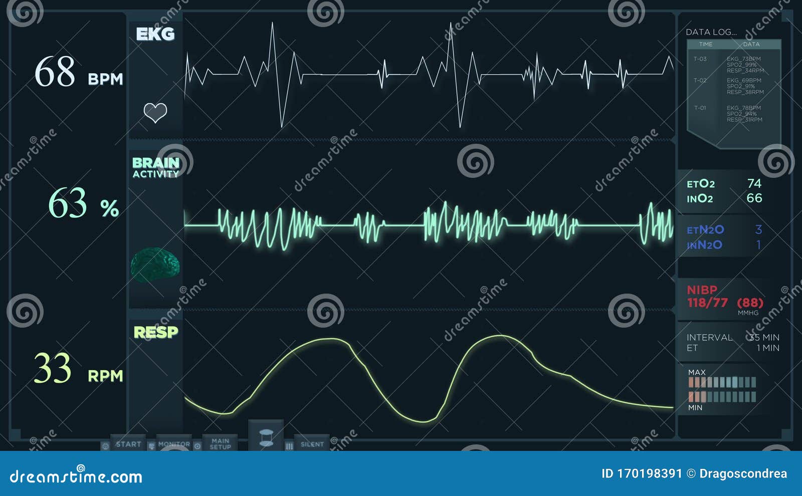 Animation of an Electrocardiogram Display Reading in Normal Mode Stock ...