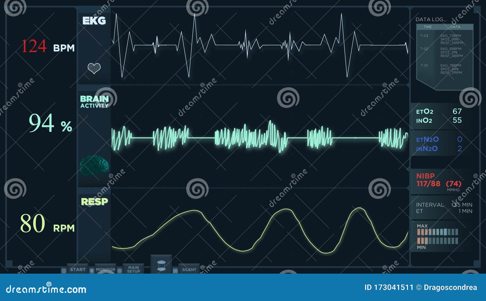 Animation of a Fast Electrocardiogram Reading Display. Stock ...