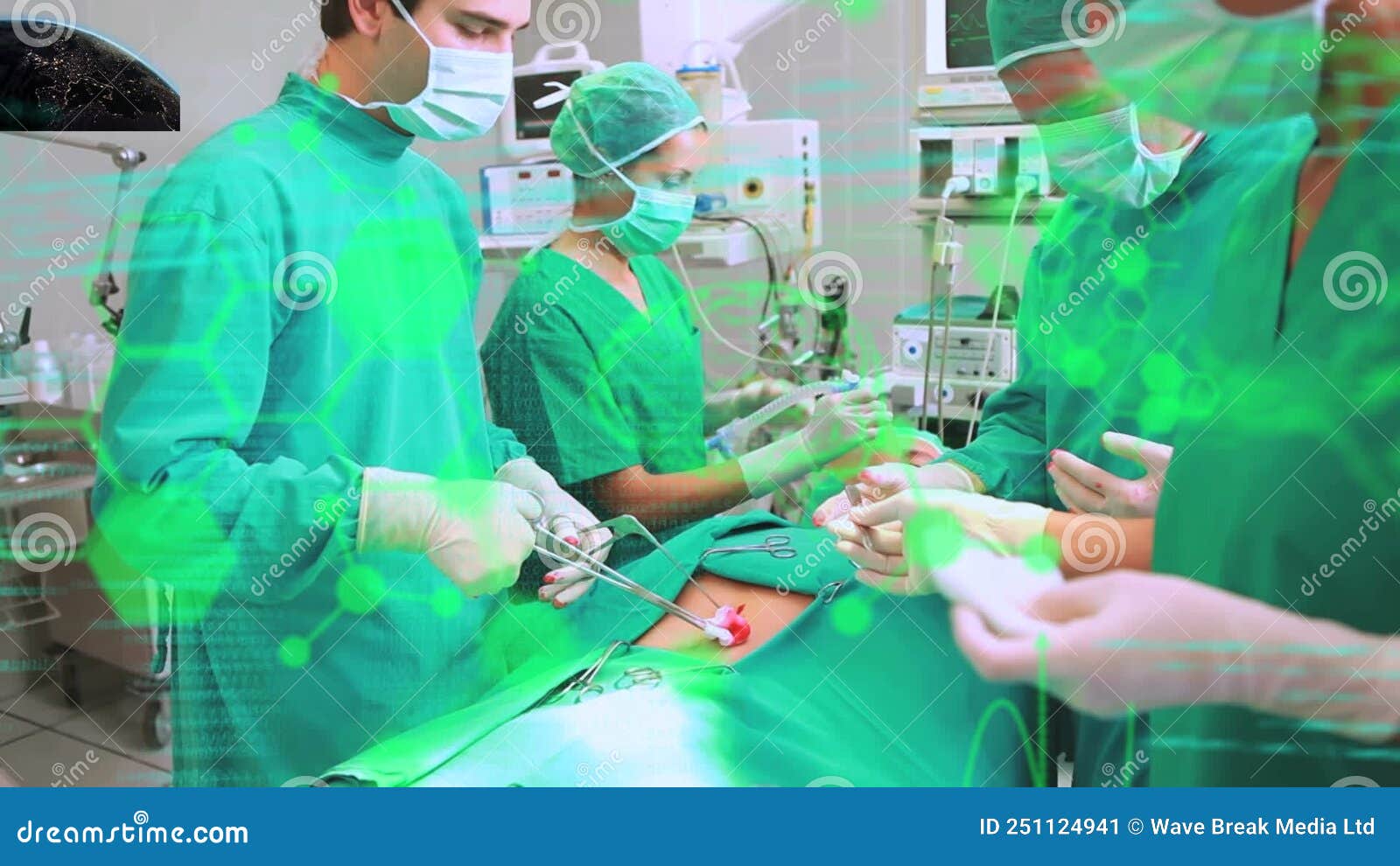 Animation of Human Brains and Data Processing Over Diverse Surgeons in ...