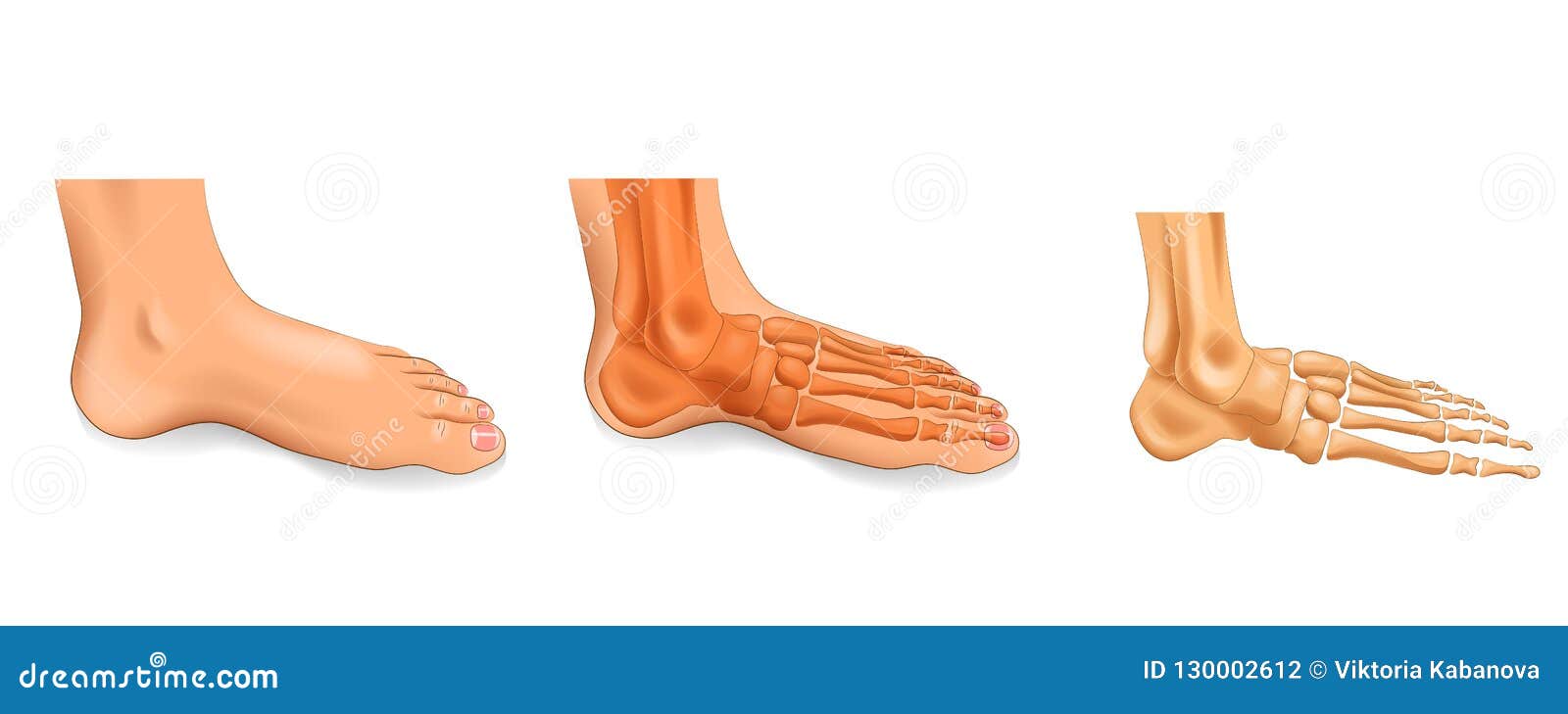 Medial Ankle Injury_Tibialis Anterior Tendonitis Cartoon Vector ...