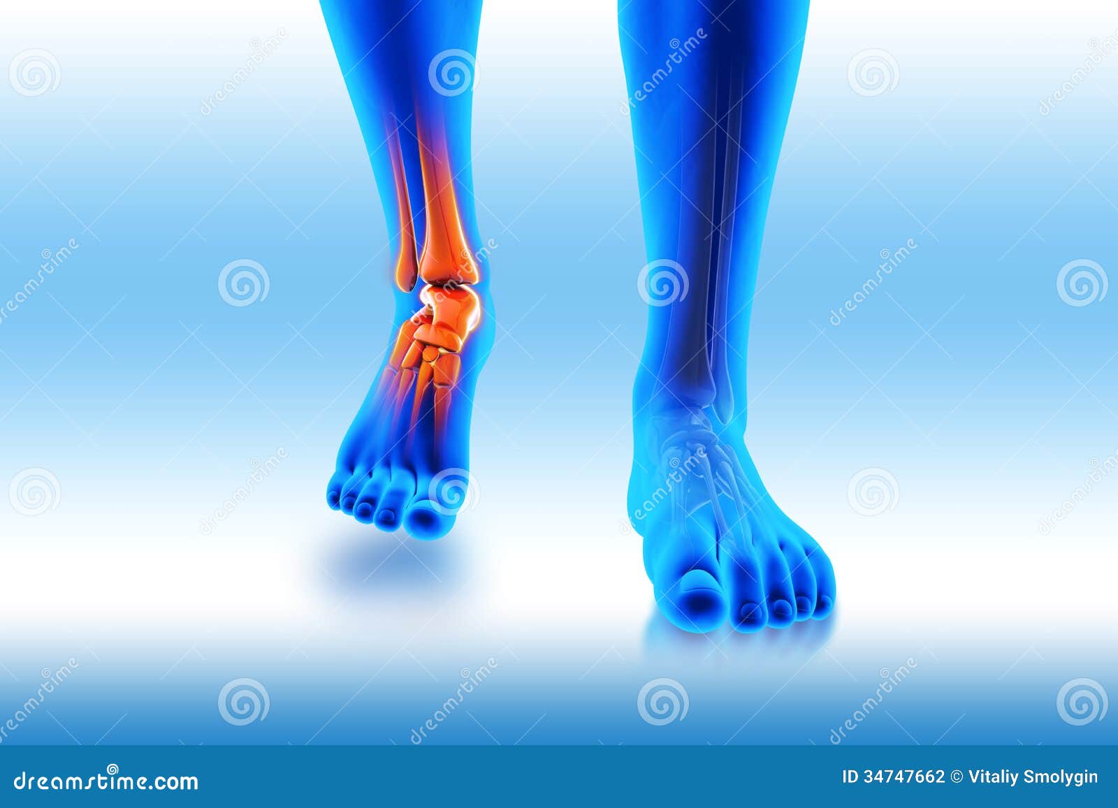 Ankle pain - hurt trauma stock illustration. Illustration of injury ...