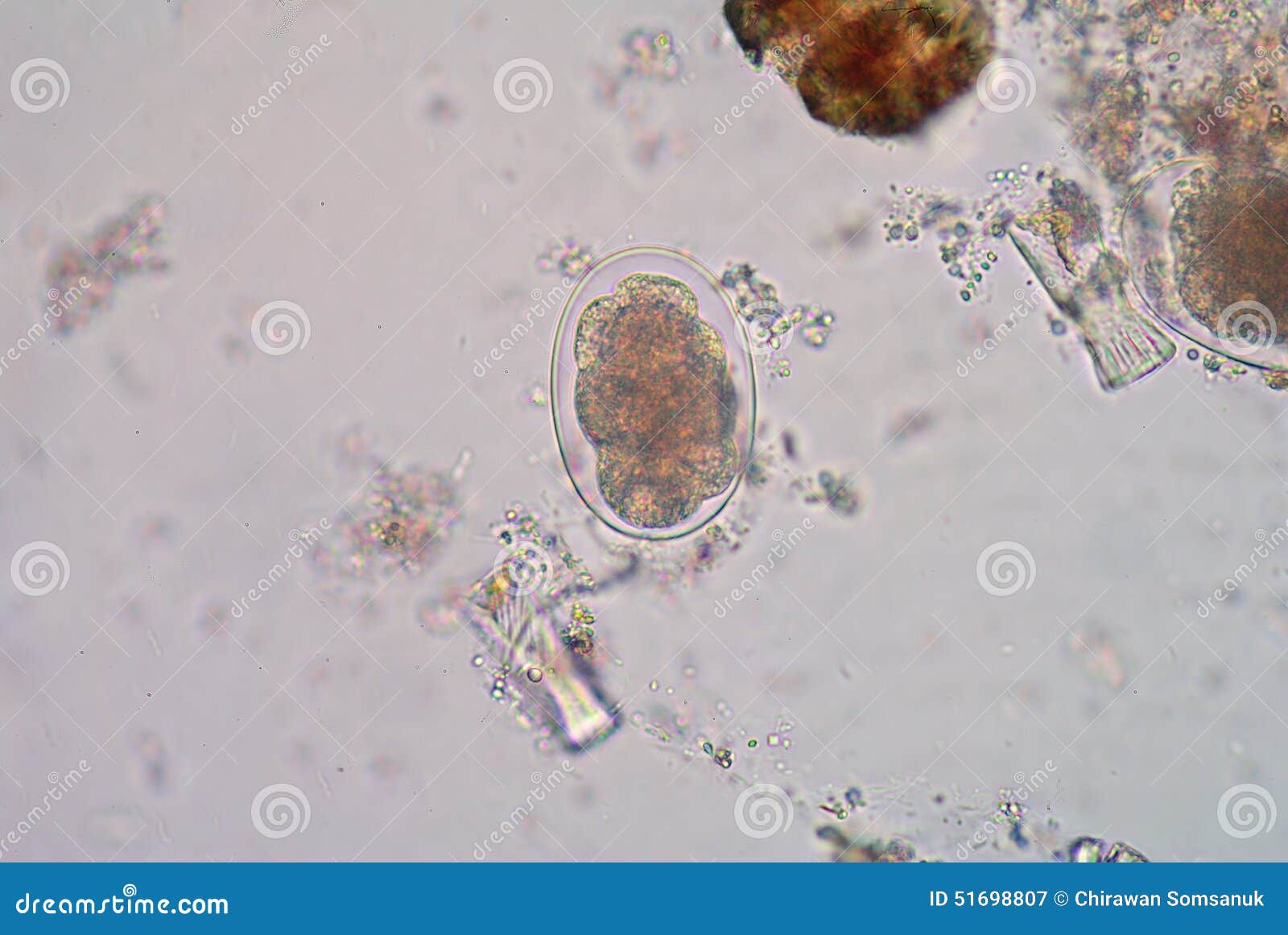 Ankylostome image stock. Image du antiseptique, maladie - 51698807