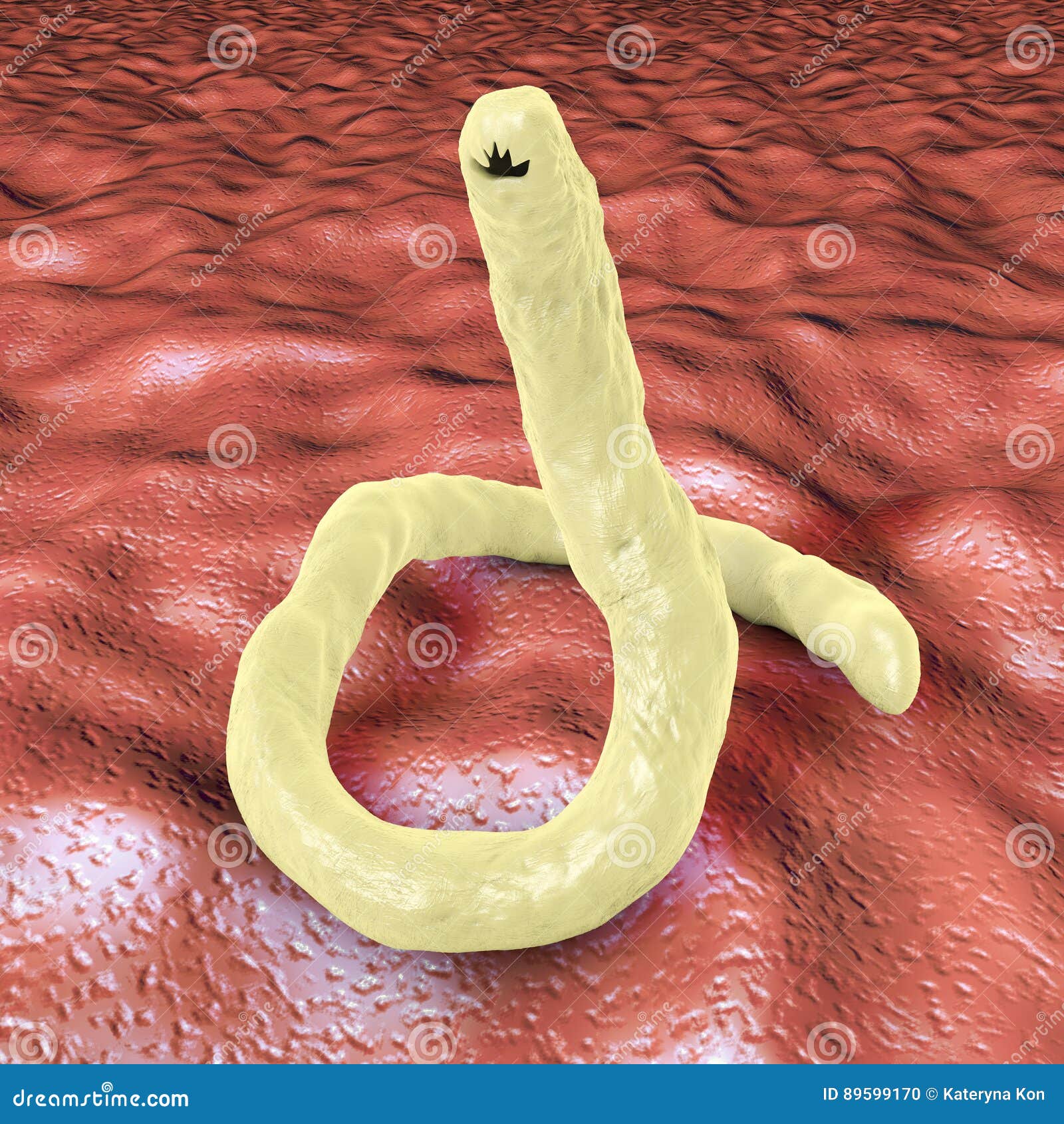 Ankylostome Parasite Ancylosoma Illustration Stock - Illustration du ...