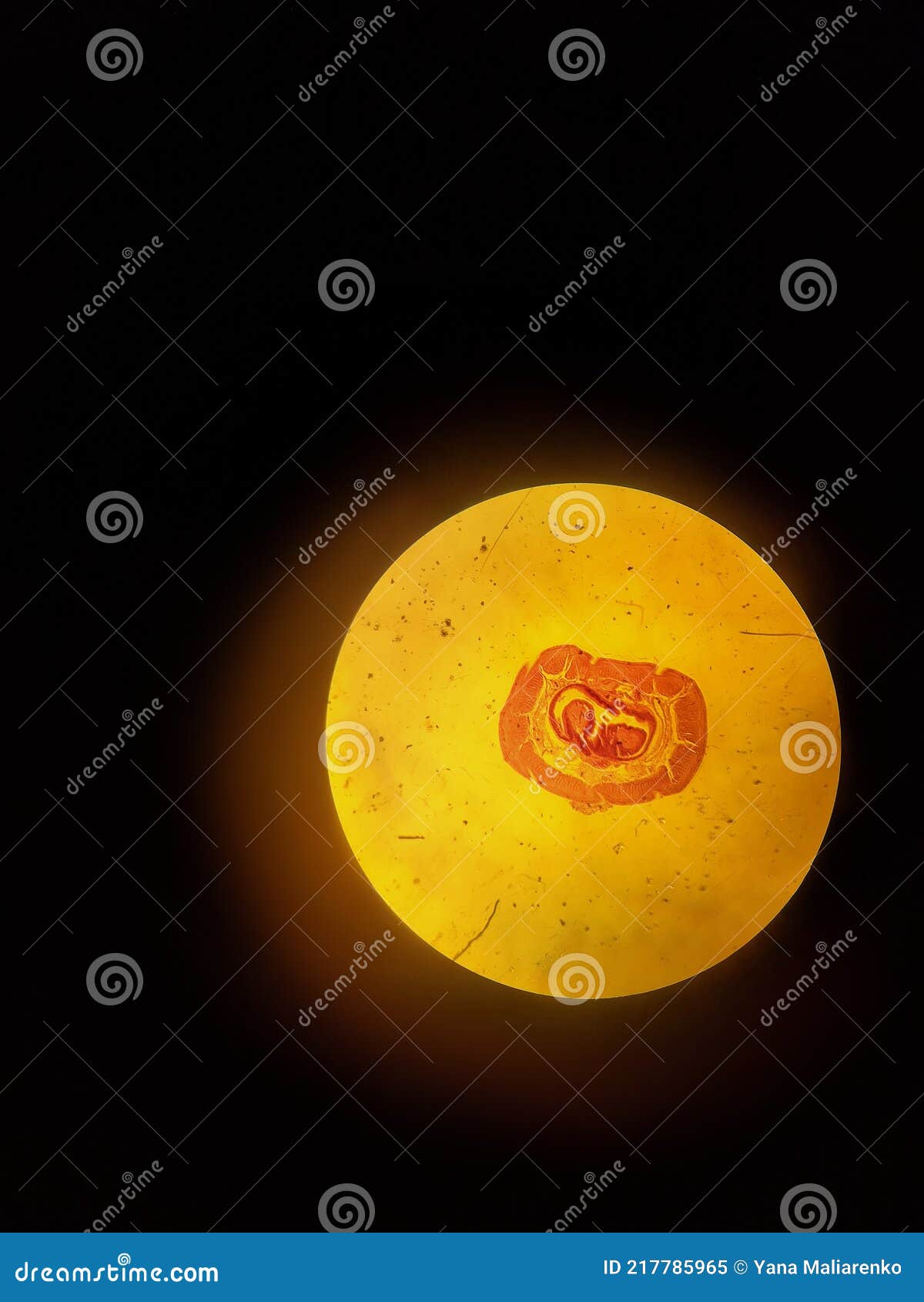 Annelid worm stock image. Image of worm, microscope - 217785965