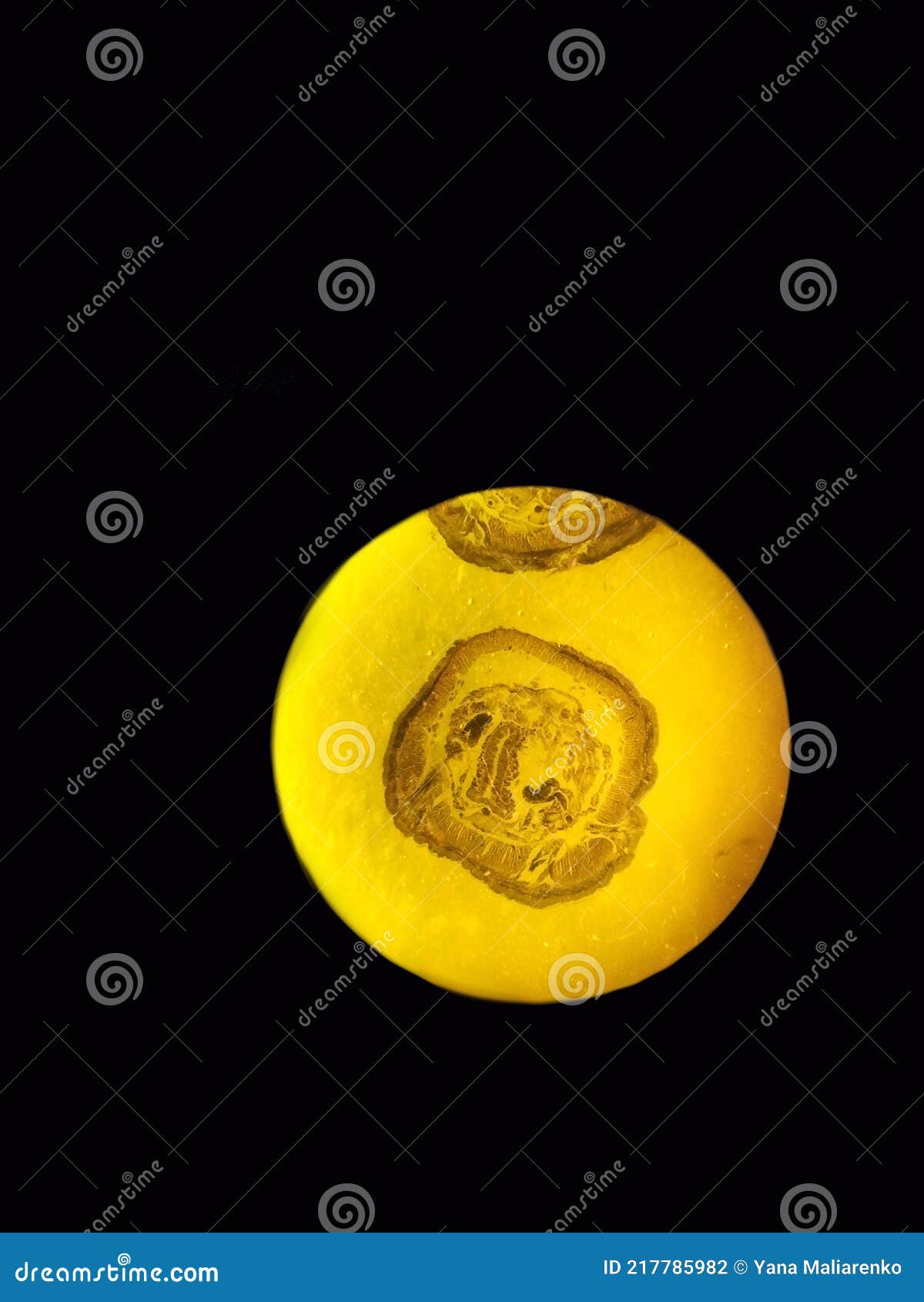 Earthworm Cross Section