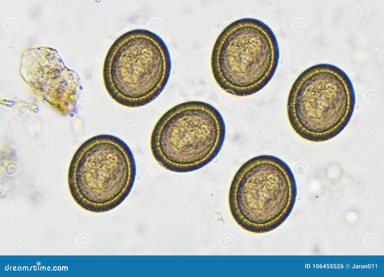 Anquilostoma en taburete foto de archivo. Imagen de micro - 106455526