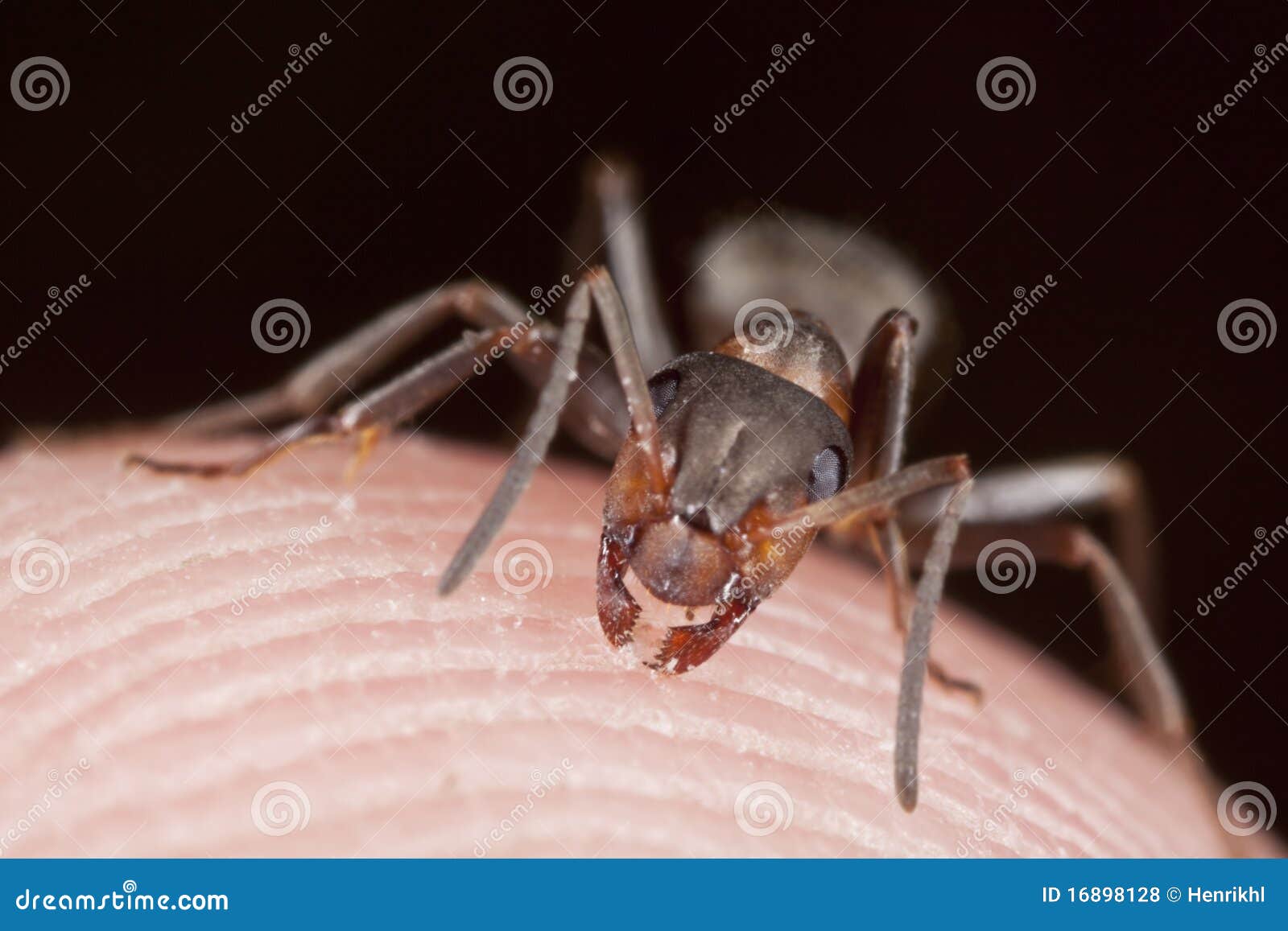 Ant Biting Skin on Human Hand Stock Photo - Image of skin, angry: 16898128