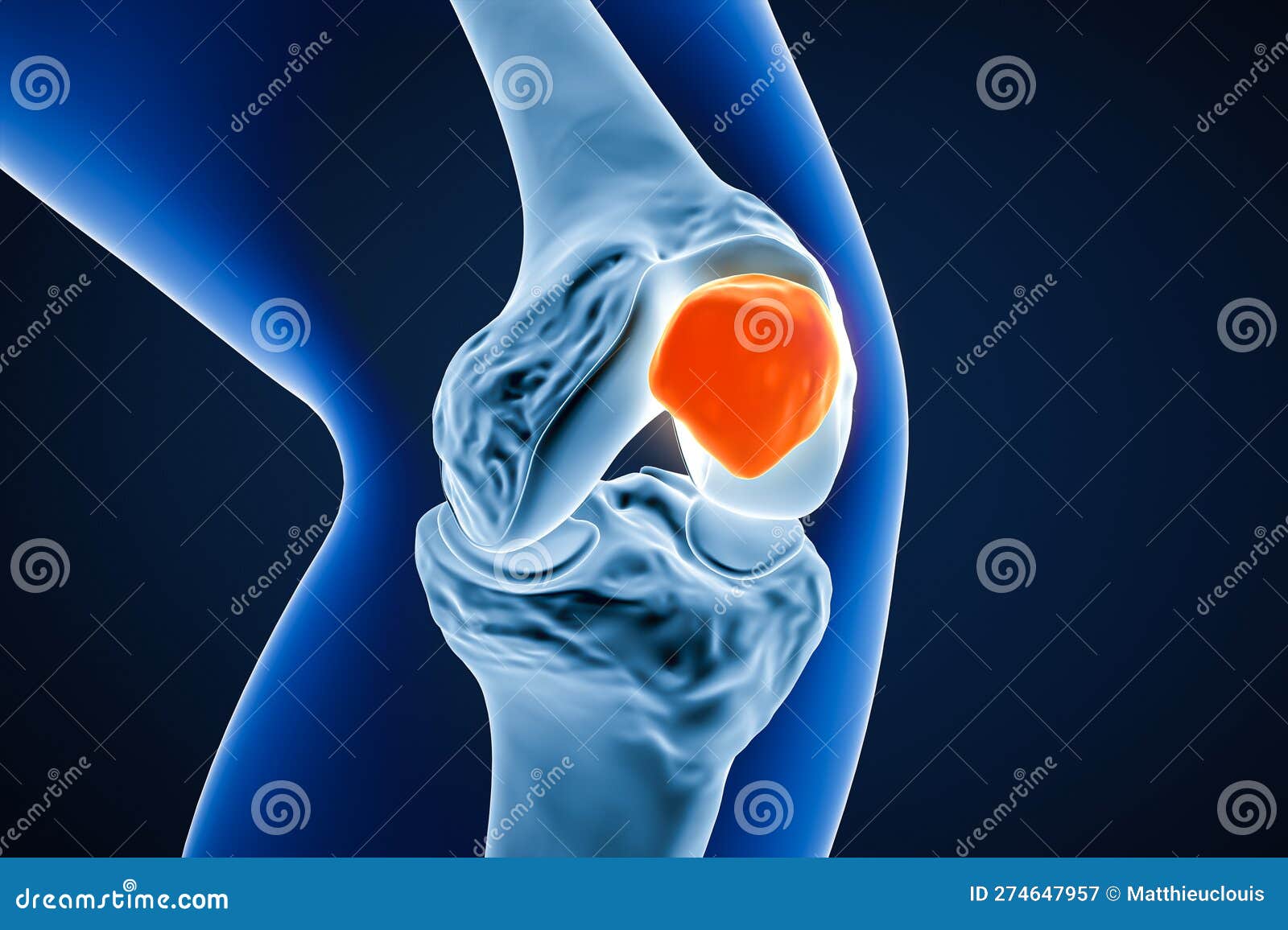 Anterior Or Front Close Up View Of The Patella Or Knee Cap Bone 3d Rendering Illustration Human