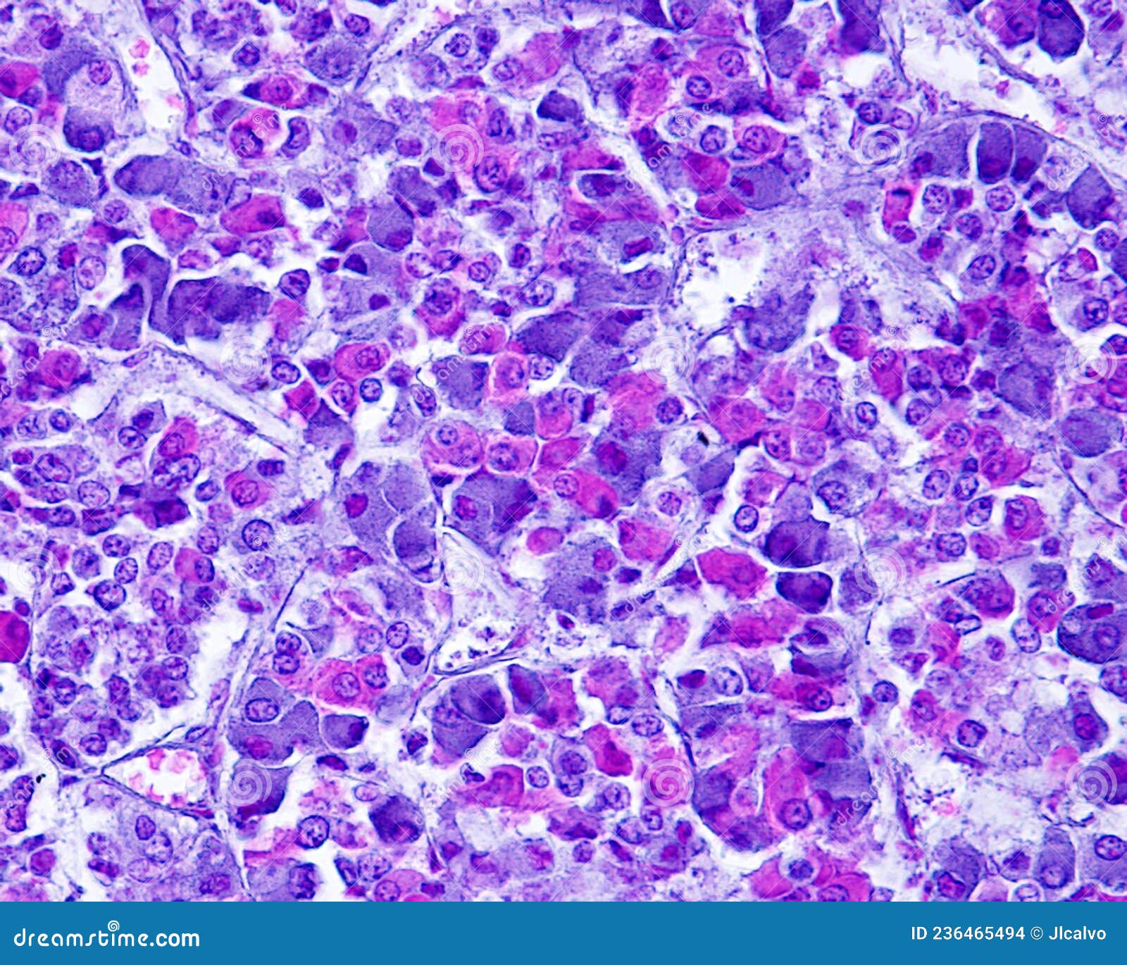 Anterior Pituitary. Gomori Trichrome Stain Stock Photo - Image of light ...